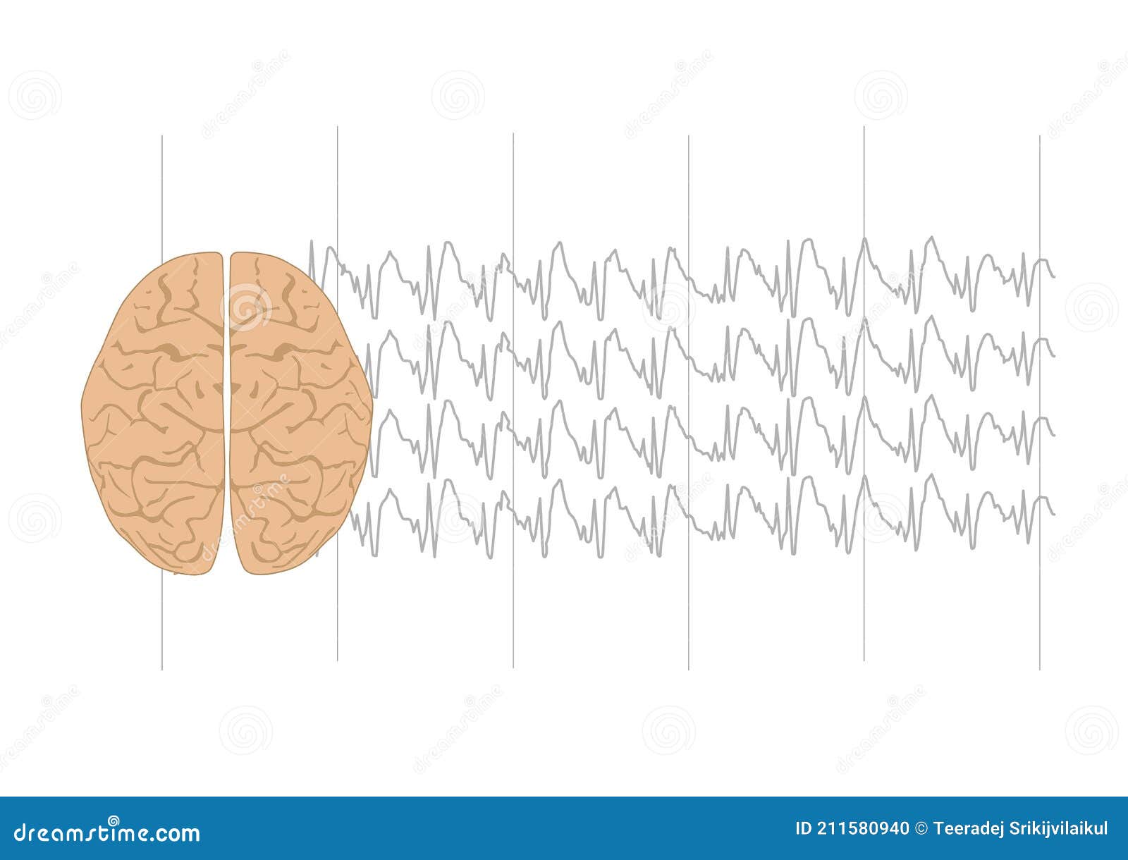 Illustration of Brain and Generalized Sharp Waves Stock Vector ... Illustration of Brain and Generalized Sharp Waves Stock Vector ...