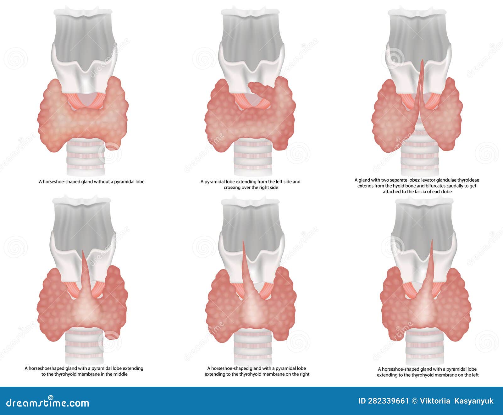 Illustration of the Classification of the Thyroid Gland Shapes. the ...