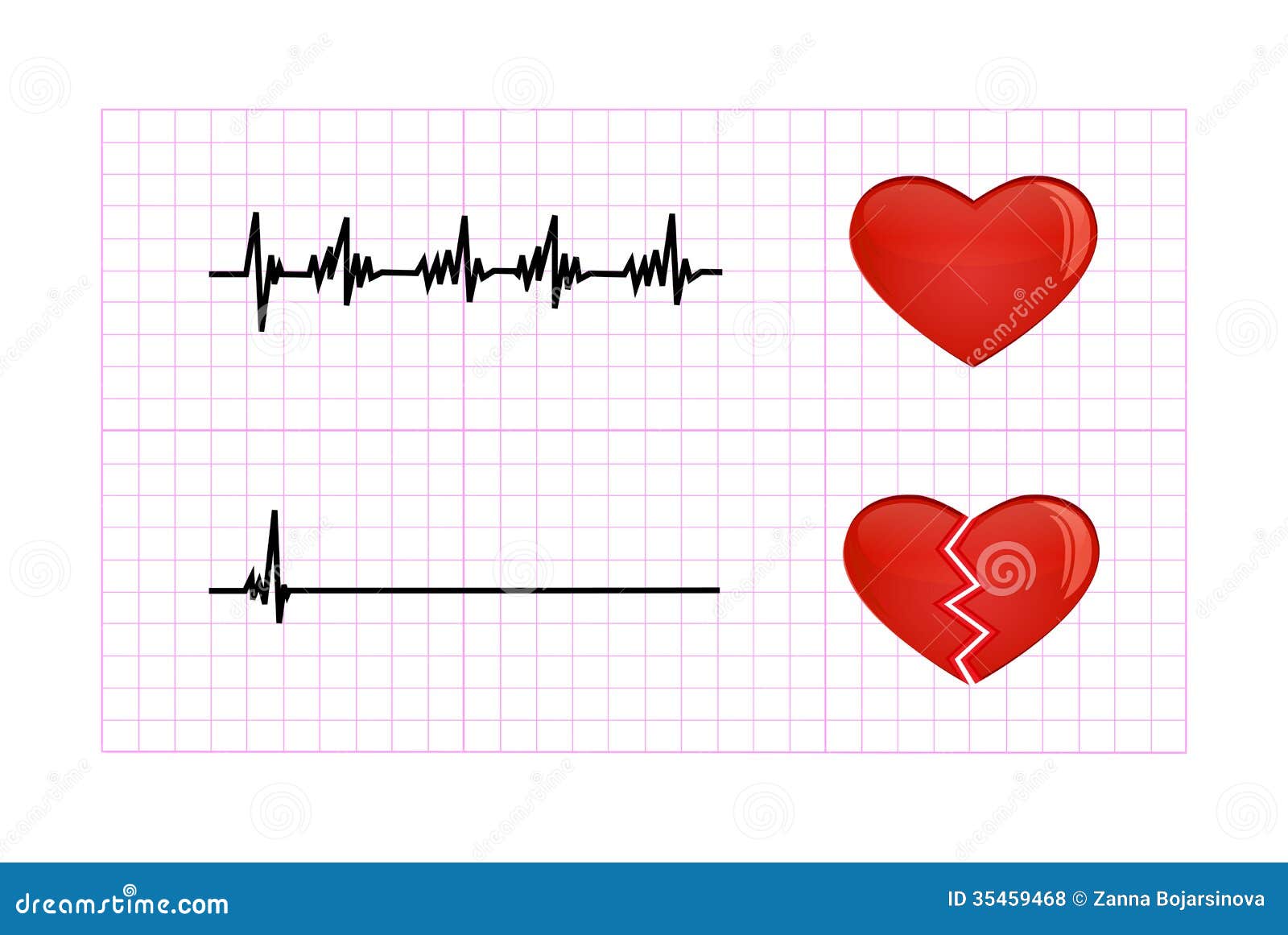 Illustration De Diagramme De Battement De Coeur Illustration de Vecteur ...