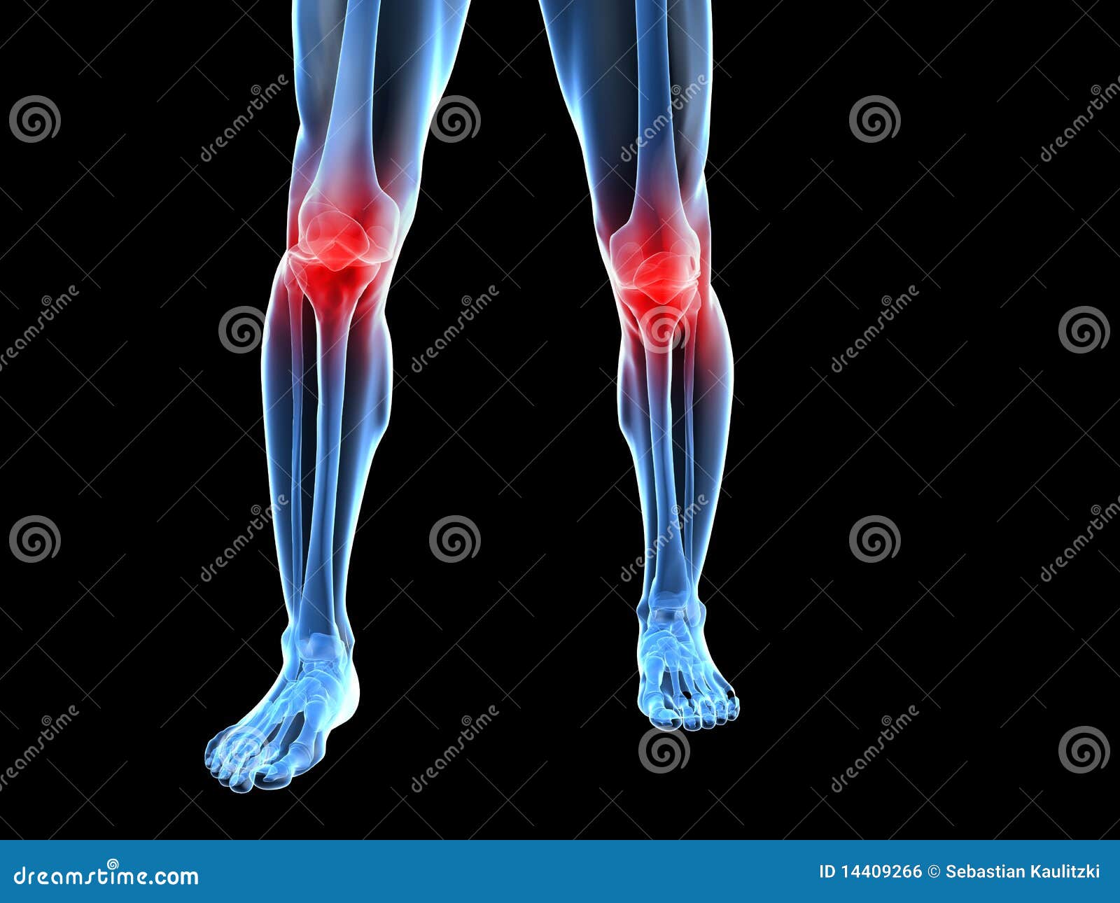 Illustration de genou illustration stock. Illustration du maladie ...