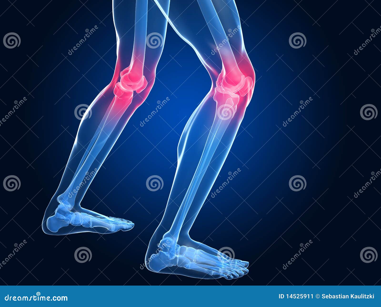 Illustration de genou illustration stock. Illustration du squelette ...