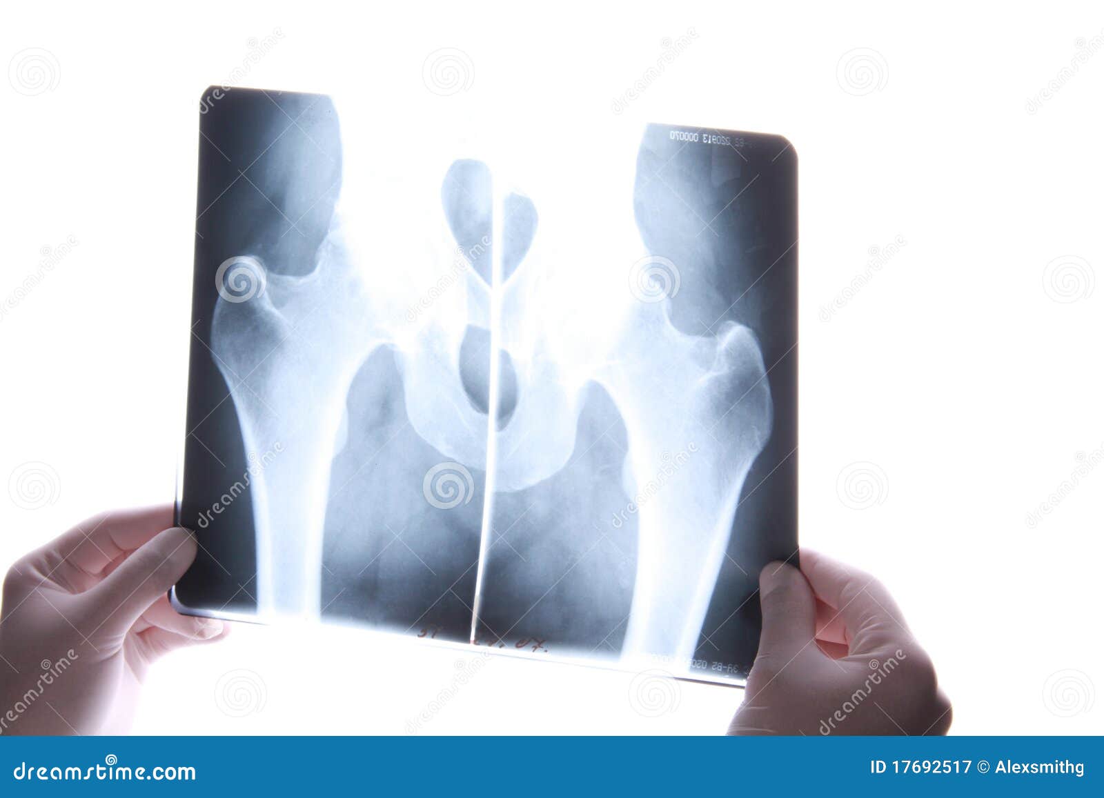 Illustration de rayon X image stock. Image du inspection - 17692517