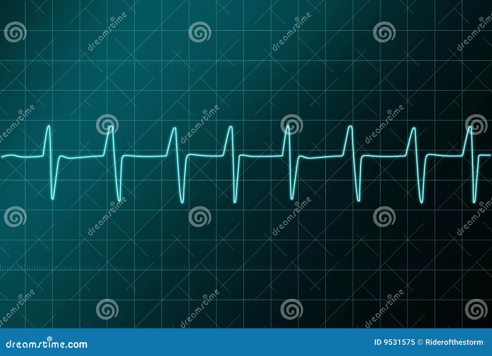 Illustration De Ritm De Cardiogramme. Illustration Stock - Illustration ...