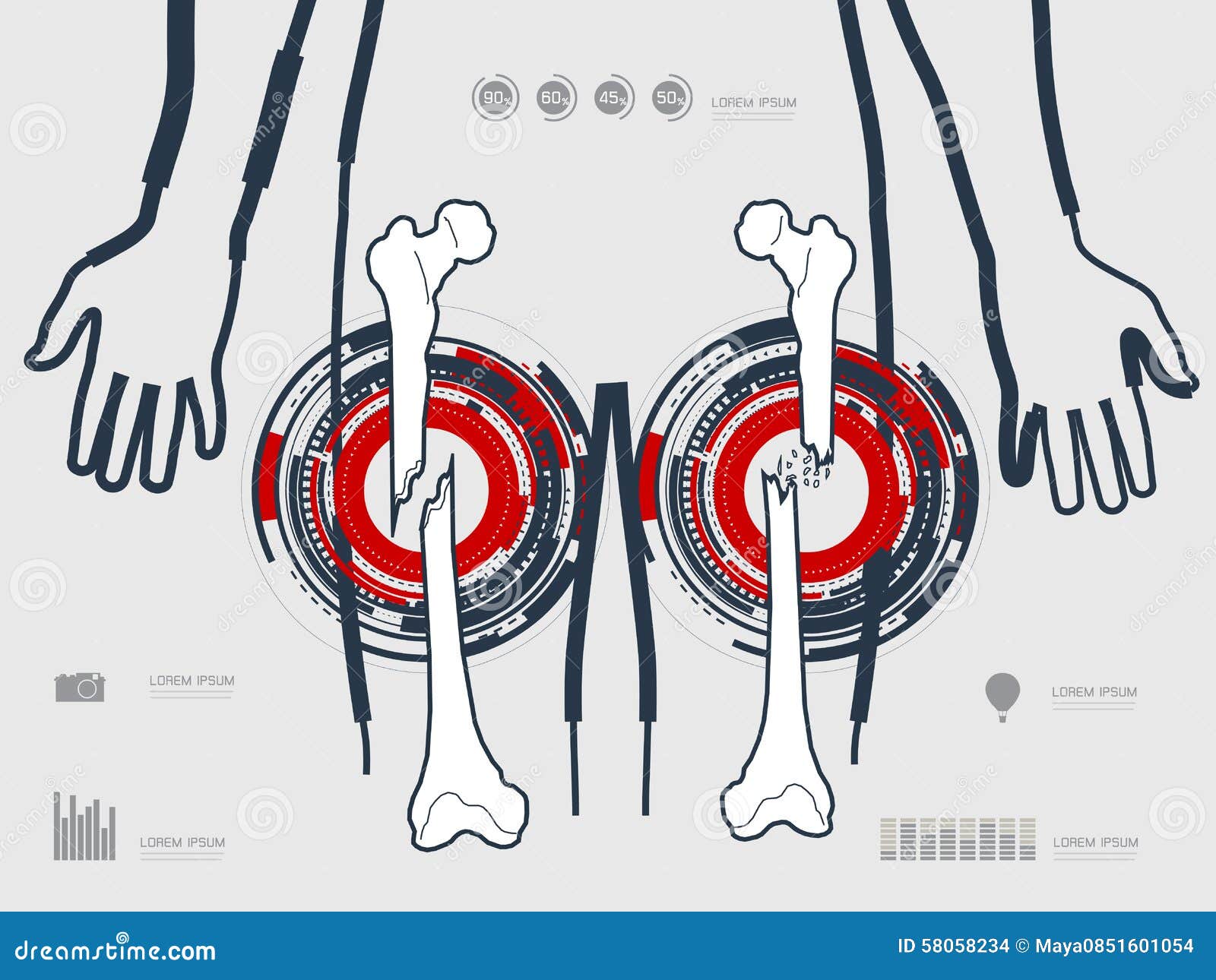 Illustration De Vecteur De La Jambe Illustration de Vecteur ...