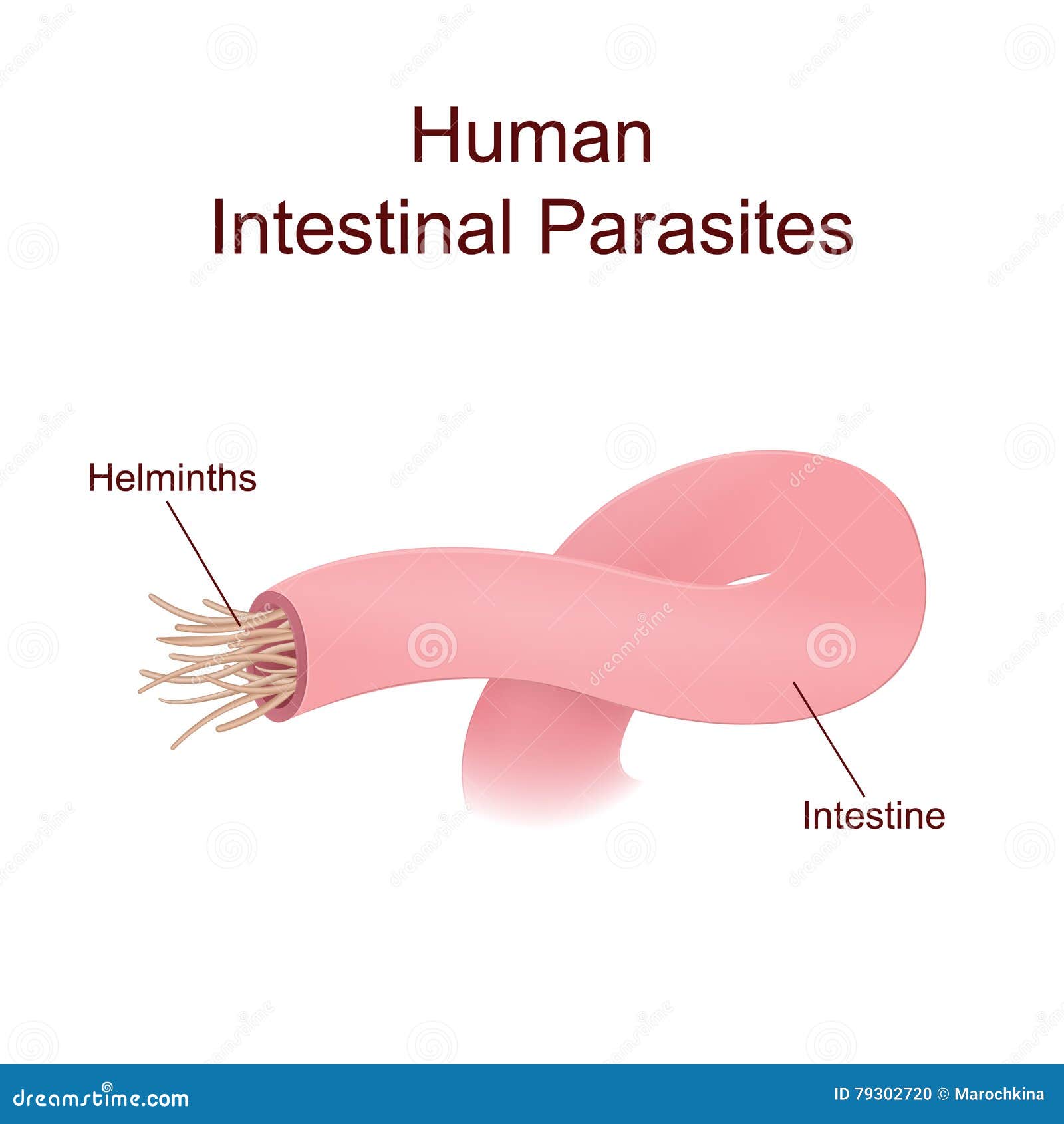 Illustration Des Parasites Humains Internes Illustration de Vecteur ...