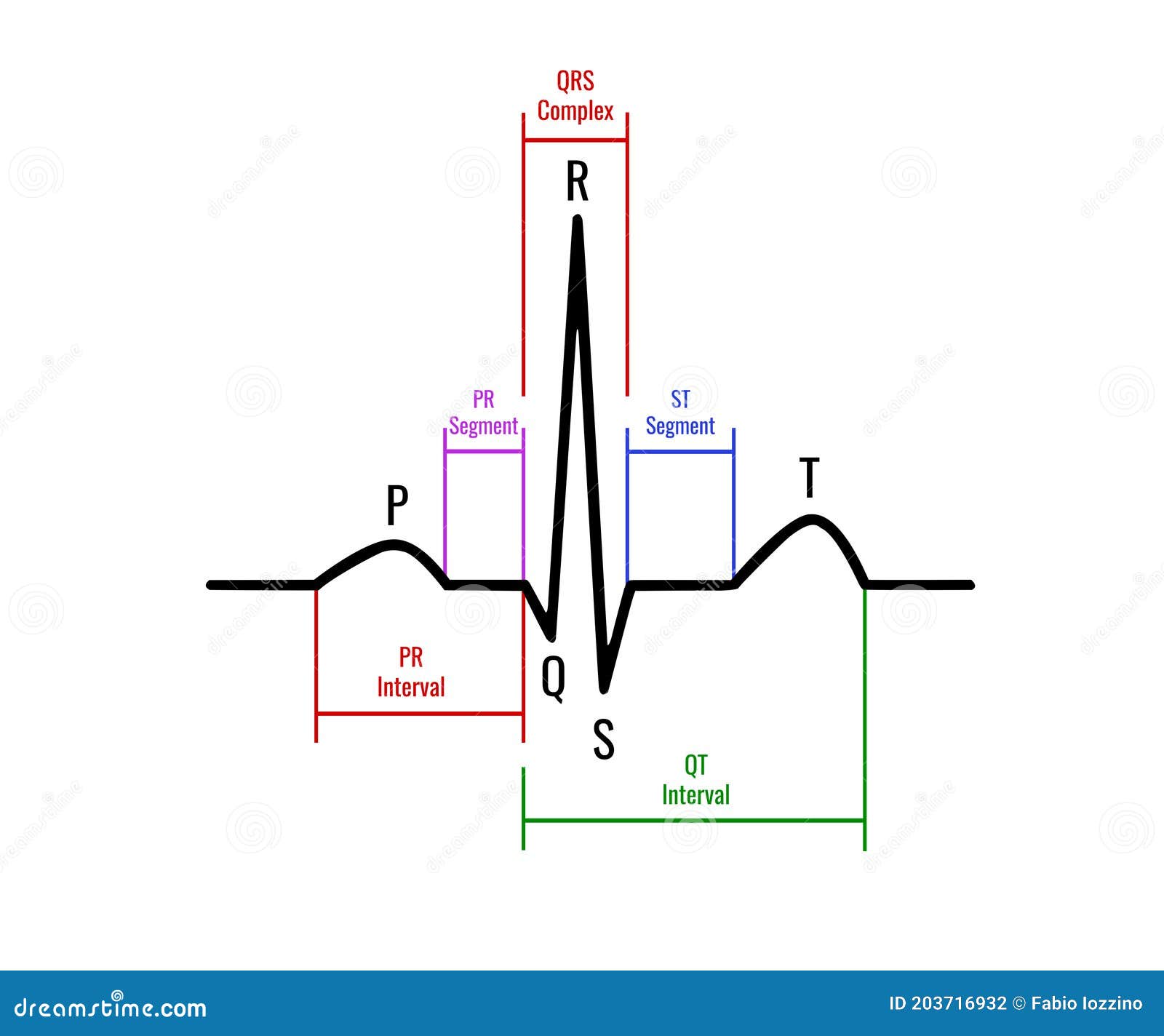 Illustration of ECG Interpretation. ECG of a Healthy Person Stock ...