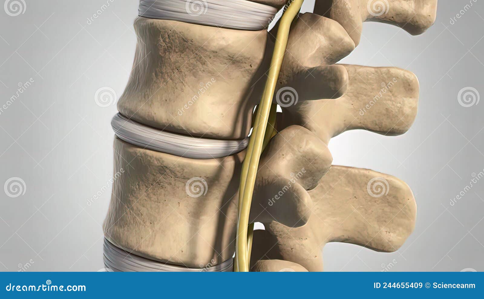 Disc Shift in the Spinal Cord Stock Illustration - Illustration of ...