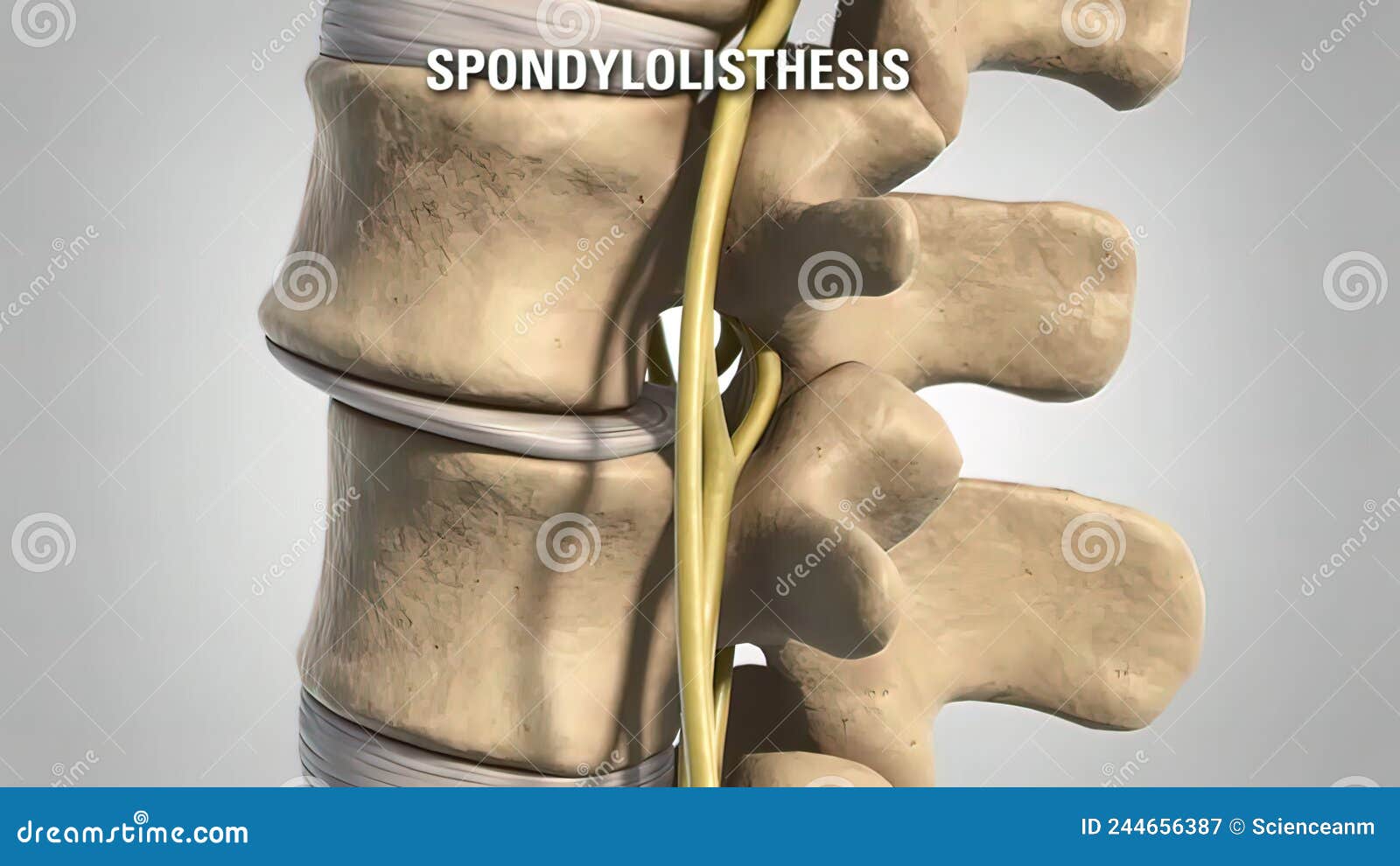 Healthy Lumbar Vertebrae And Intervertebral Disc. Labeled Illustration ...