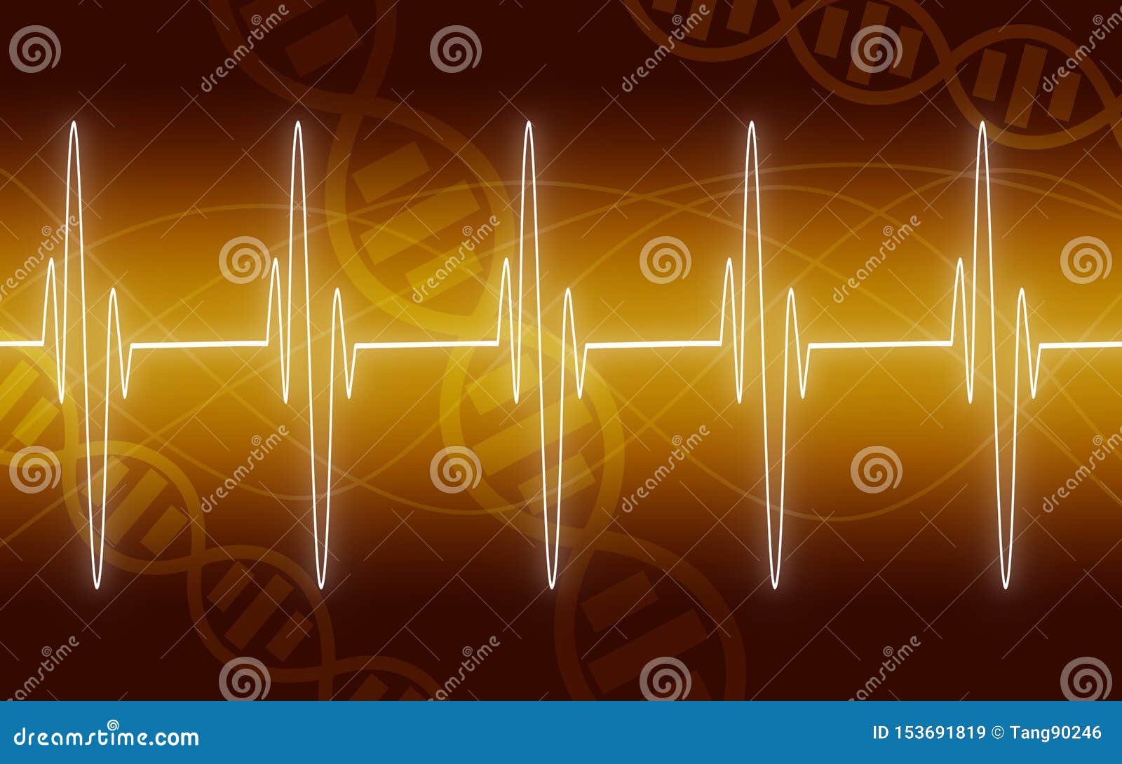 Illustration of EKG Trace on Yellow Background Stock Illustration ...