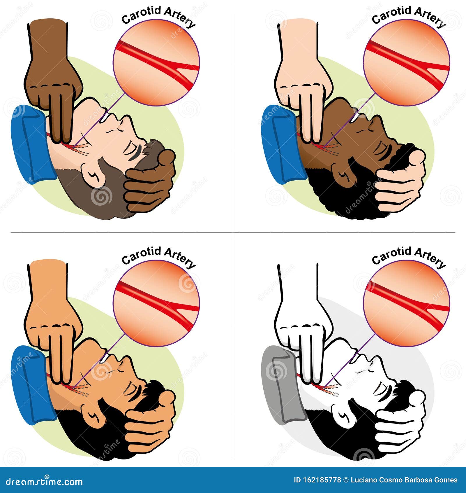First Aid Measuring Pulse Through The Carotid Artery With Clock Vector ... First Aid Measuring Pulse Through The Carotid Artery With Clock Vector ...