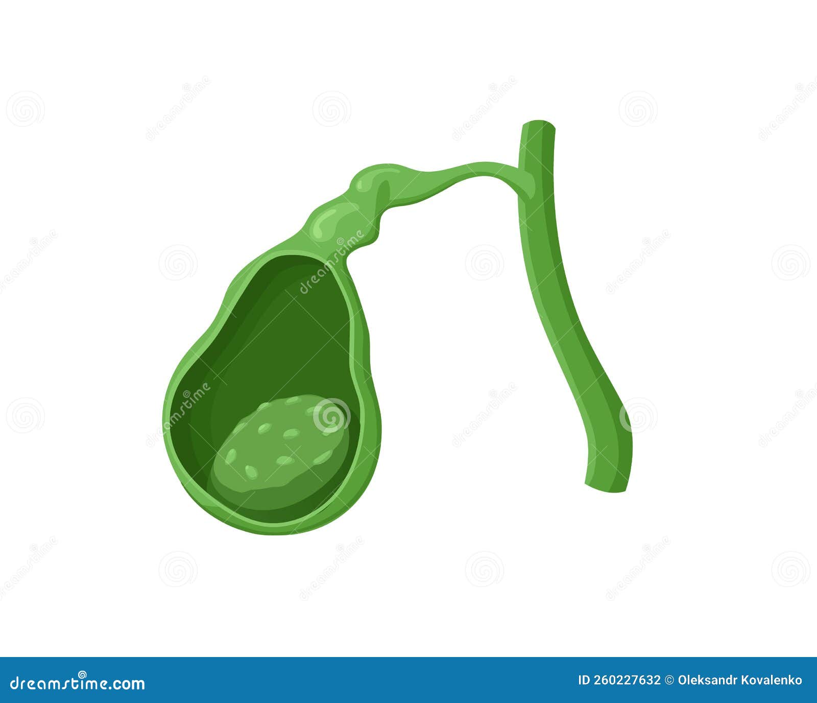 Illustration Of The Gallbladder Mass. Vector Image Of The Gallbladder ...
