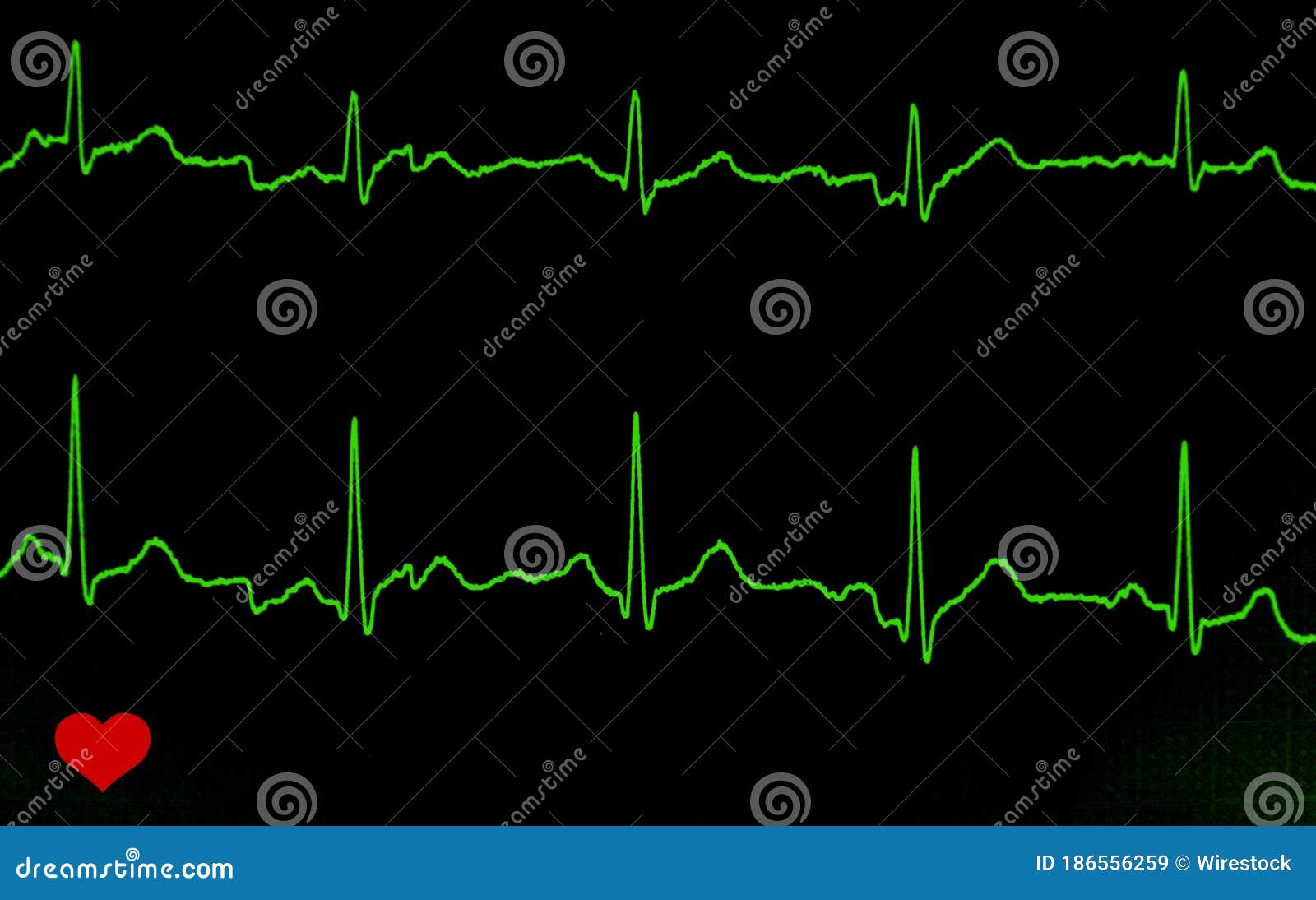 Illustration Of ECG Electrocardiography And Anatomy Of Human Heart ...
