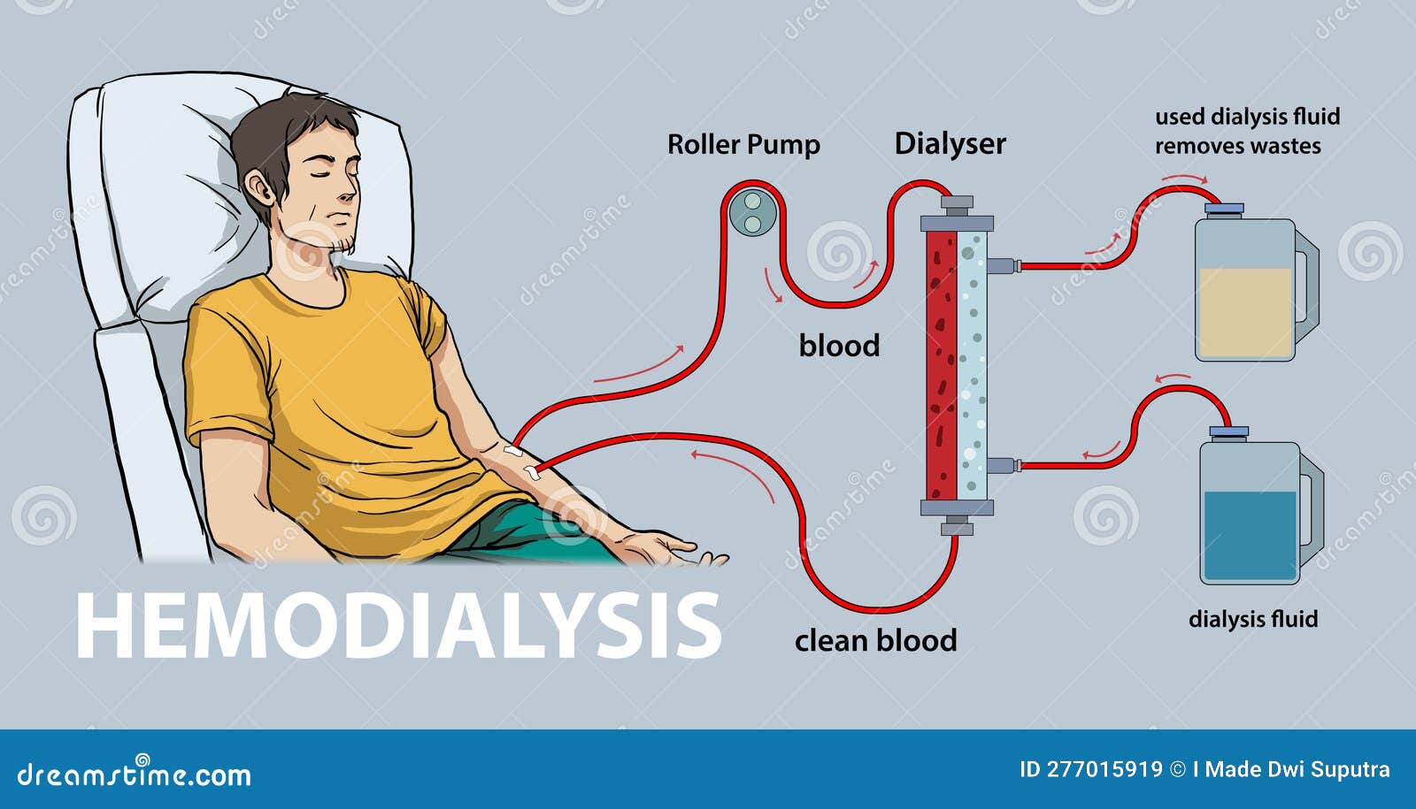 Components Of Hemodialysis Diagram Hemodialysis Machine Proc