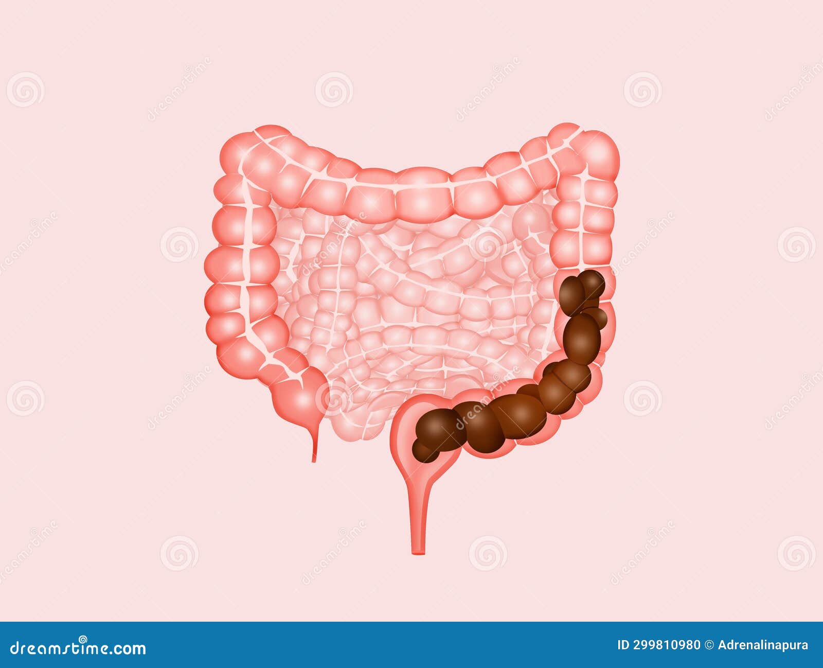 Illustration of the Intestine with Feces Stock Illustration ...
