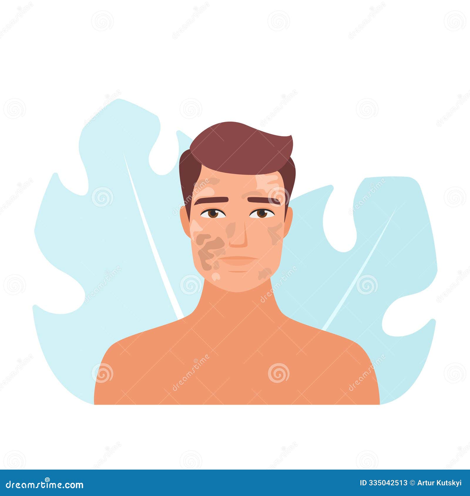Hyperpigmentation Cartoons, Illustrations & Vector Stock Images - 901 ...