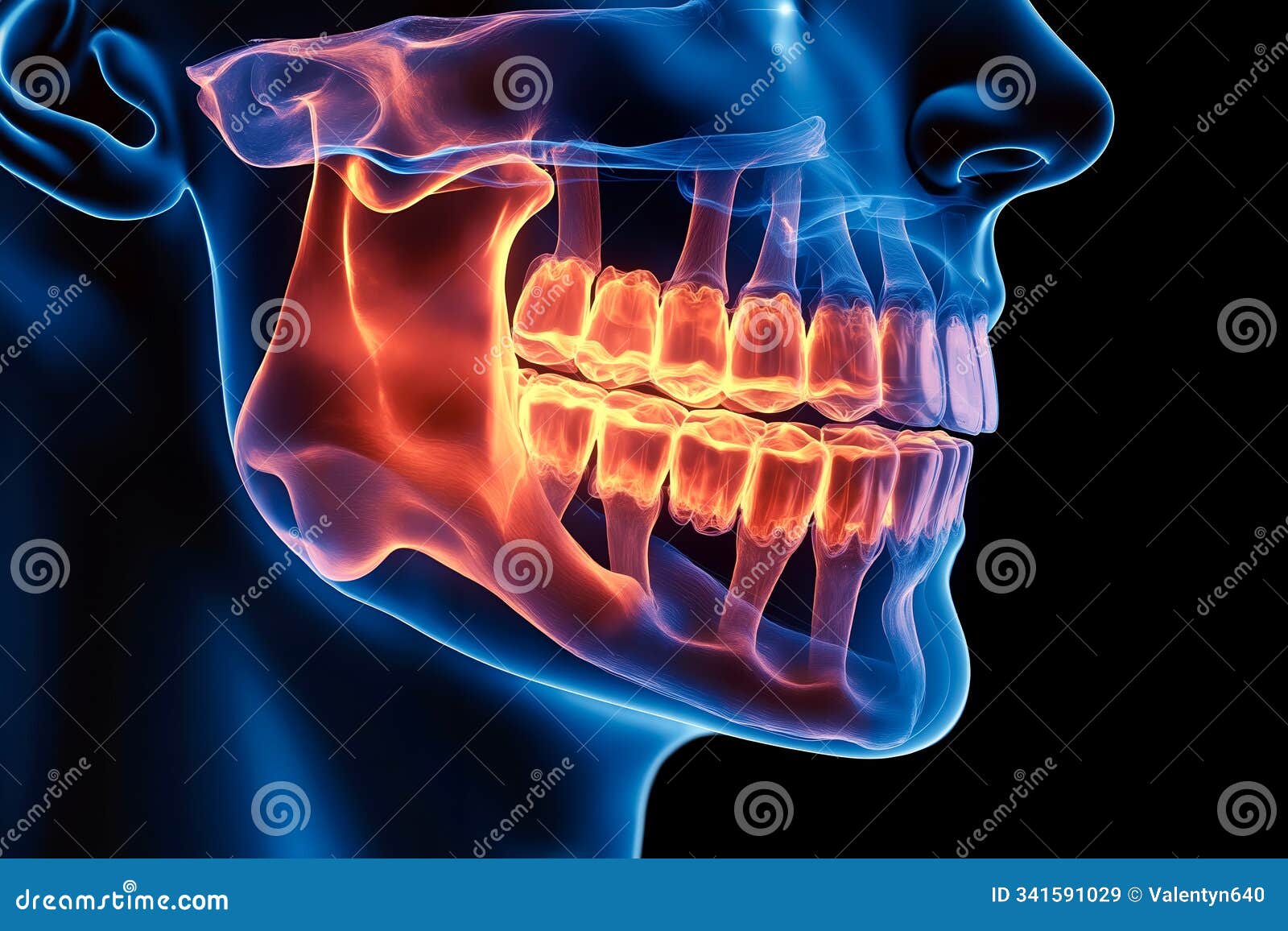 An Illustration of a Man S Mouth with a Missing Tooth Stock ...