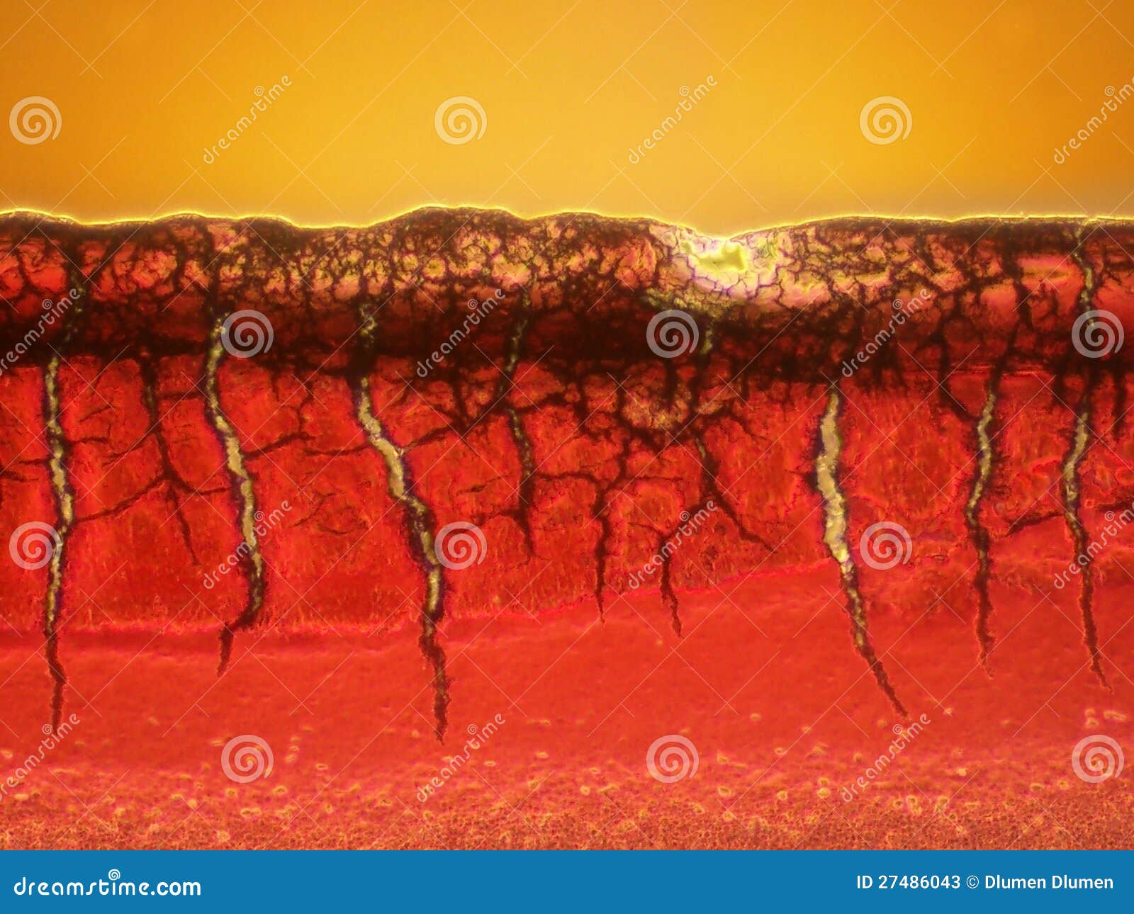 Illustration Microscopique D'un Caillot De Sang Image stock - Image du ...