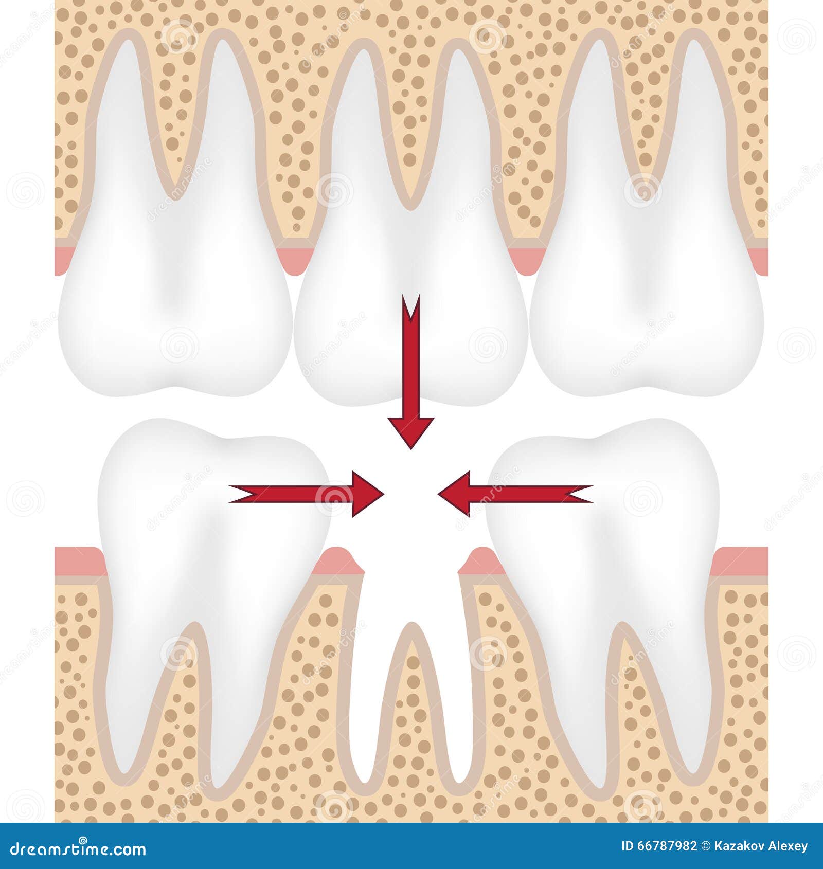 Missing Tooth - Cartoon Vector Outline Style | CartoonDealer.com #91112429