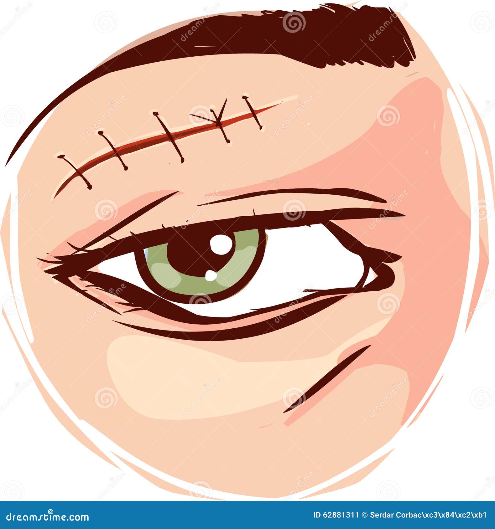 Illustration of a Receiving First Aid, Injury or Cut and Sutured Face ...
