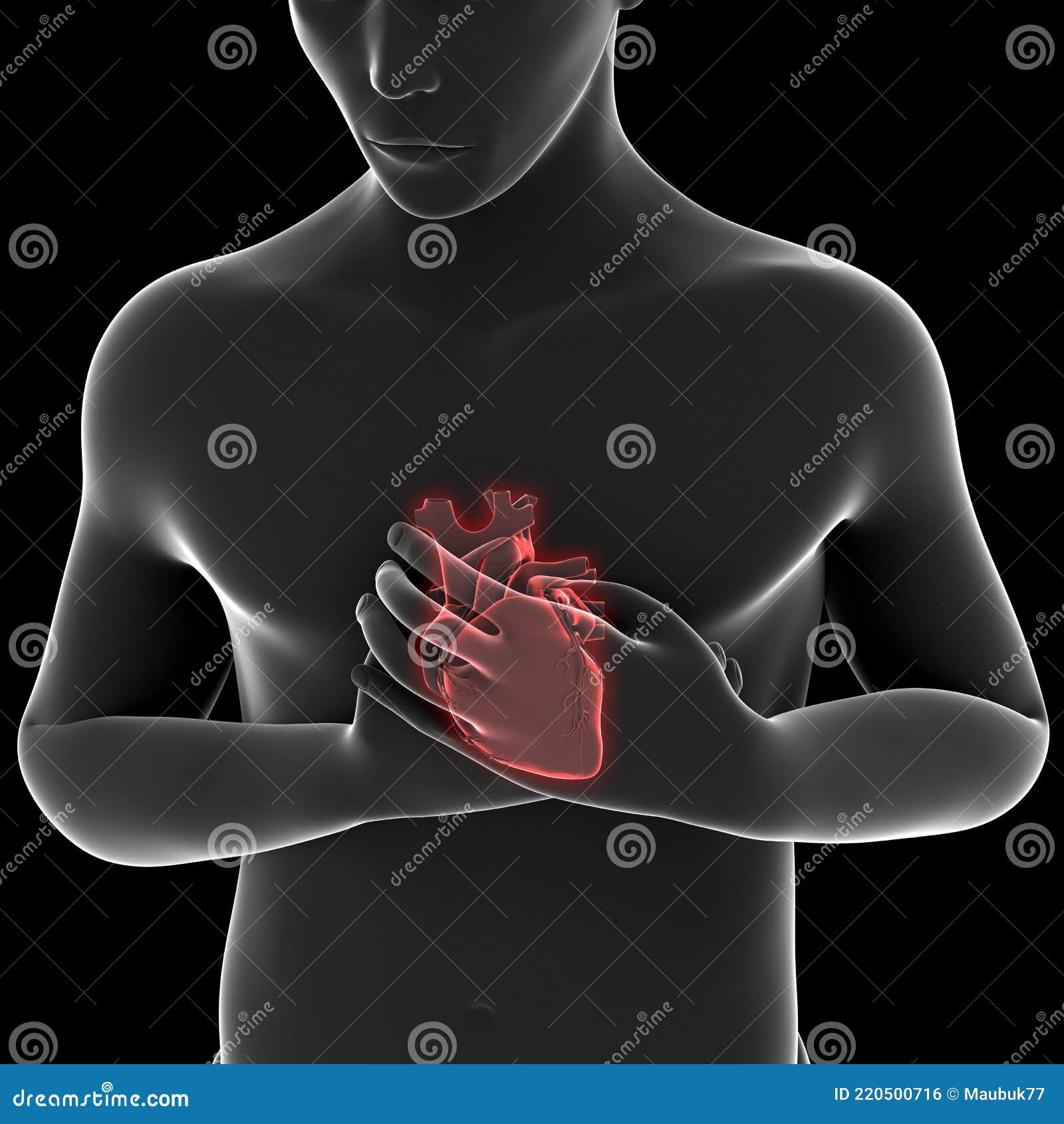 Illustration Shows a Man Suffering from Heart Attack Stock Illustration ...