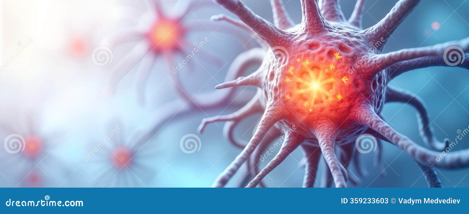 Illustration Shows Nerve Cell Damage. Inflammation Affects Nerve System ...