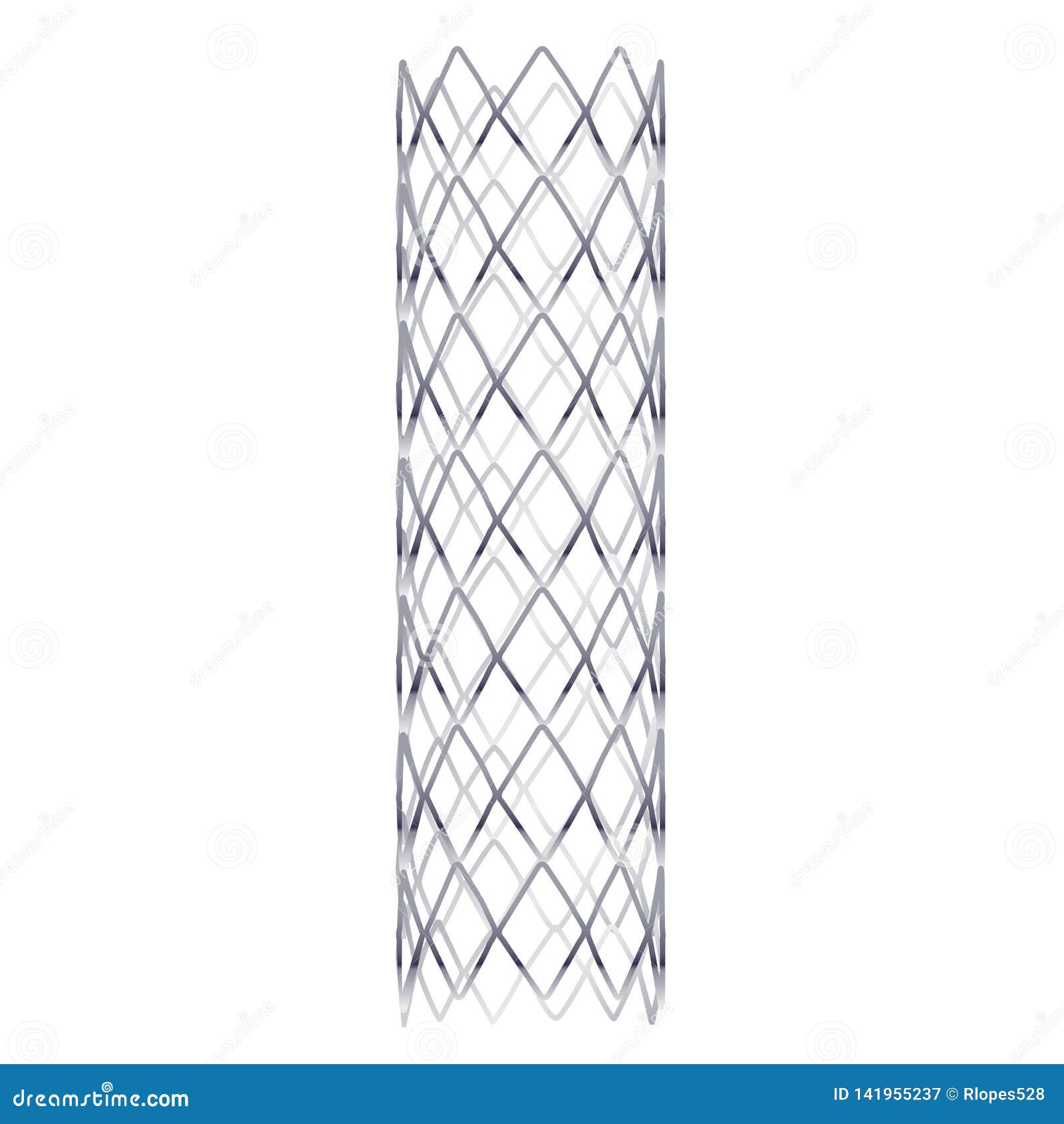 Illustration of a stent stock illustration. Illustration of surgical ...