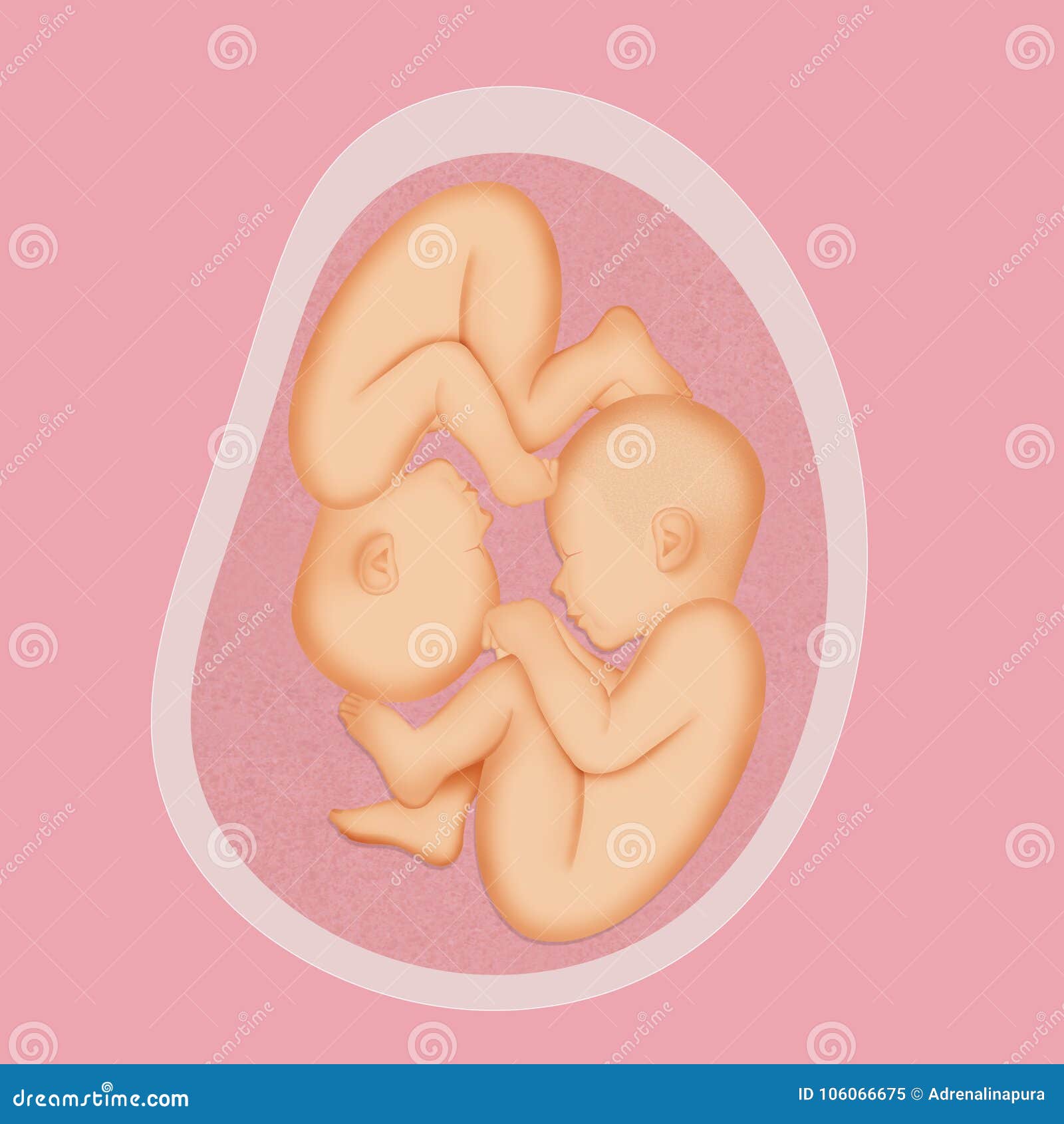 Twins In Uterus. Monozygotic And Dizygotic Cartoon Vector ...