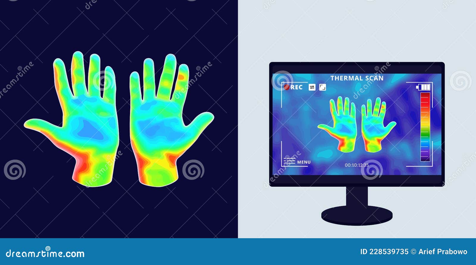 Illustration Vector Graphic of Thermal Image Scanning Two Human Hands ...