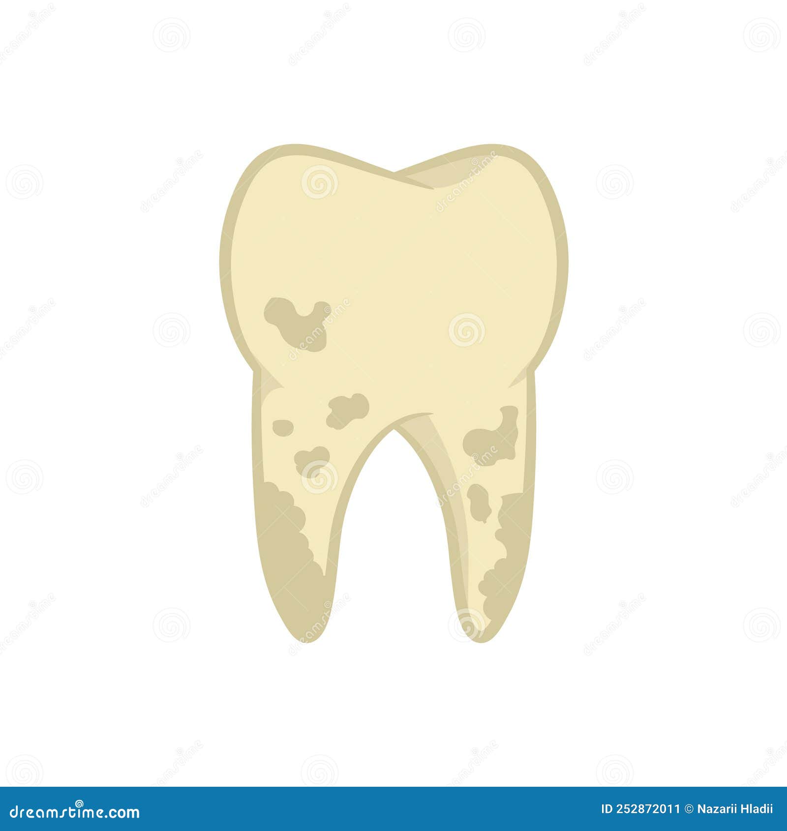 Illustration Vectorielle D'une Dent Jaune Malsaine Avec Caries ...