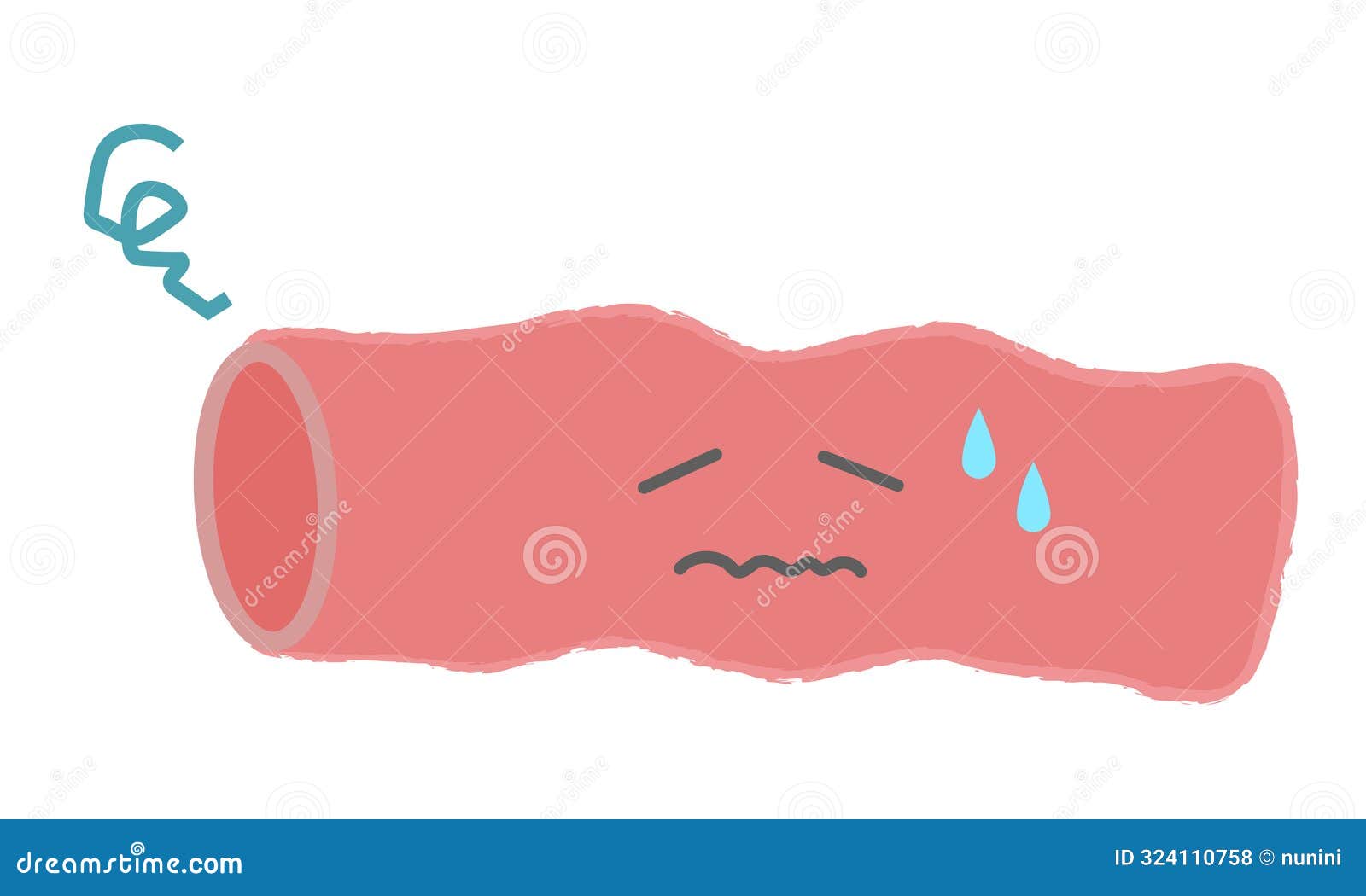 Illustration of Weak Blood Vessels Stock Illustration - Illustration of ...