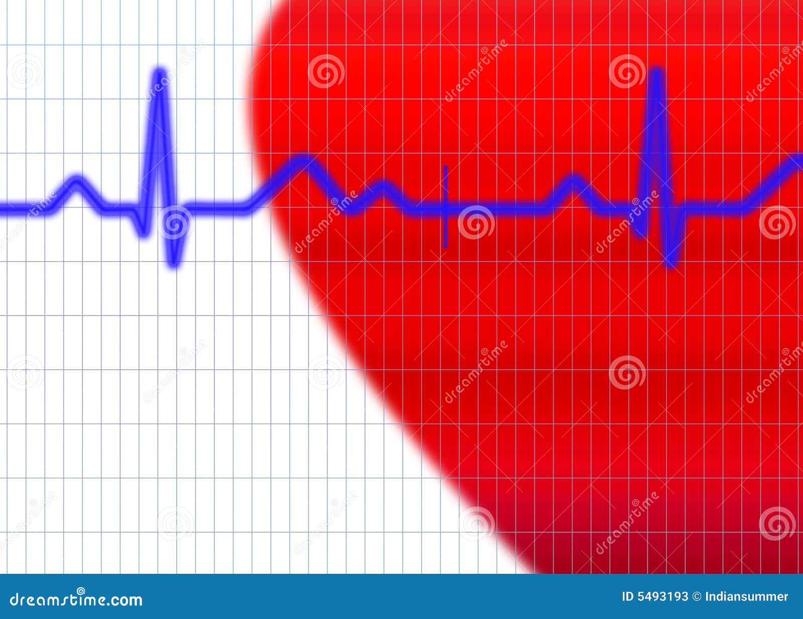 Illustrazione Del Cardiogramma Immagine. Immagine: 5493193