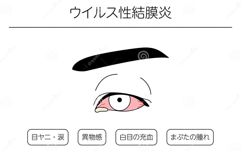 Ilustración De La Línea De Clipart Médica De La Enfermedad Ocular Y