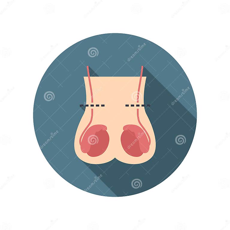 Ilustración Vectorial De Icono Plano De Vasectomía Stock de ilustración - Ilustración de aislado ...