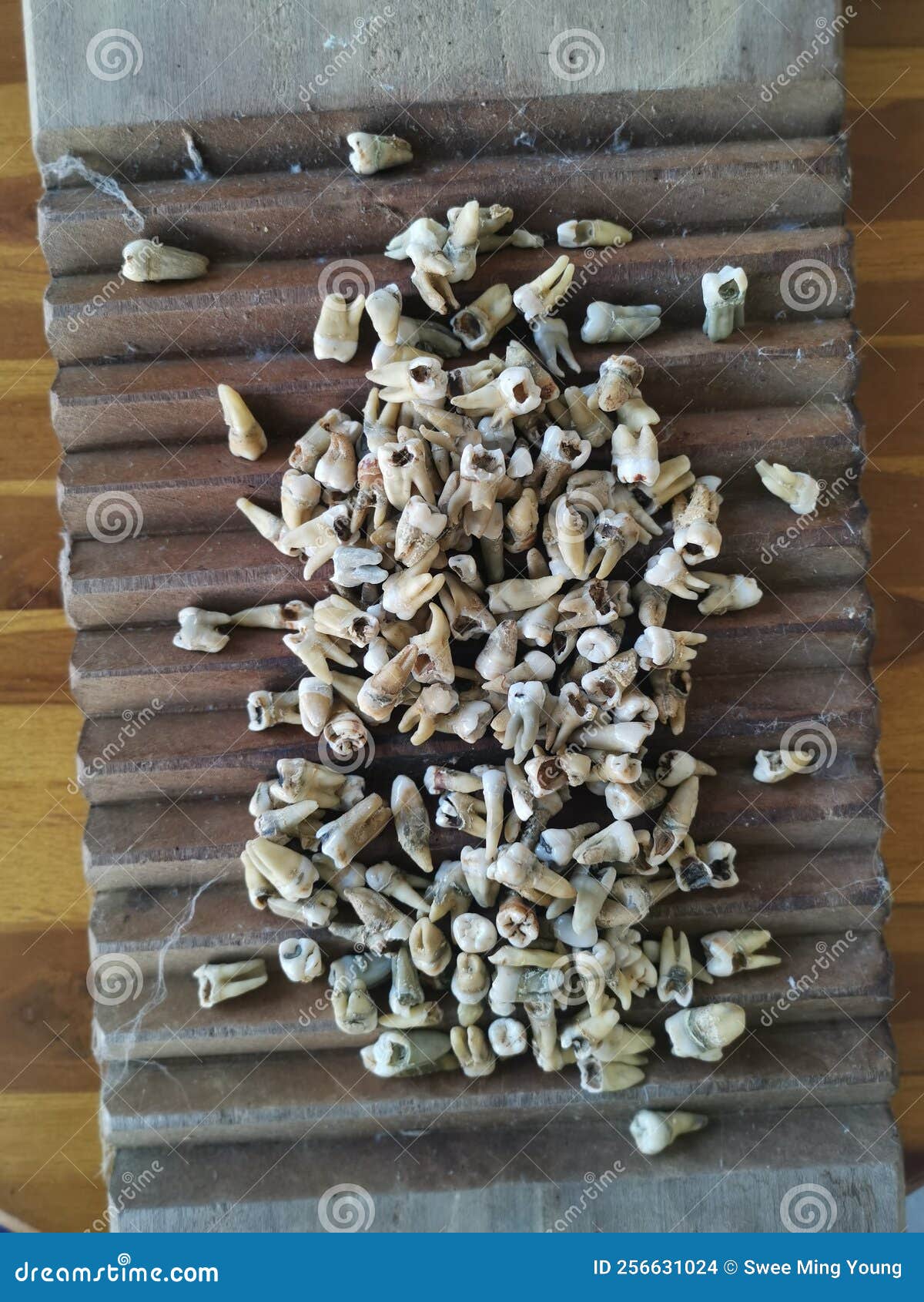 The Bundle of Unwanted Extracted Decay Human Teeth. Stock Photo - Image ...