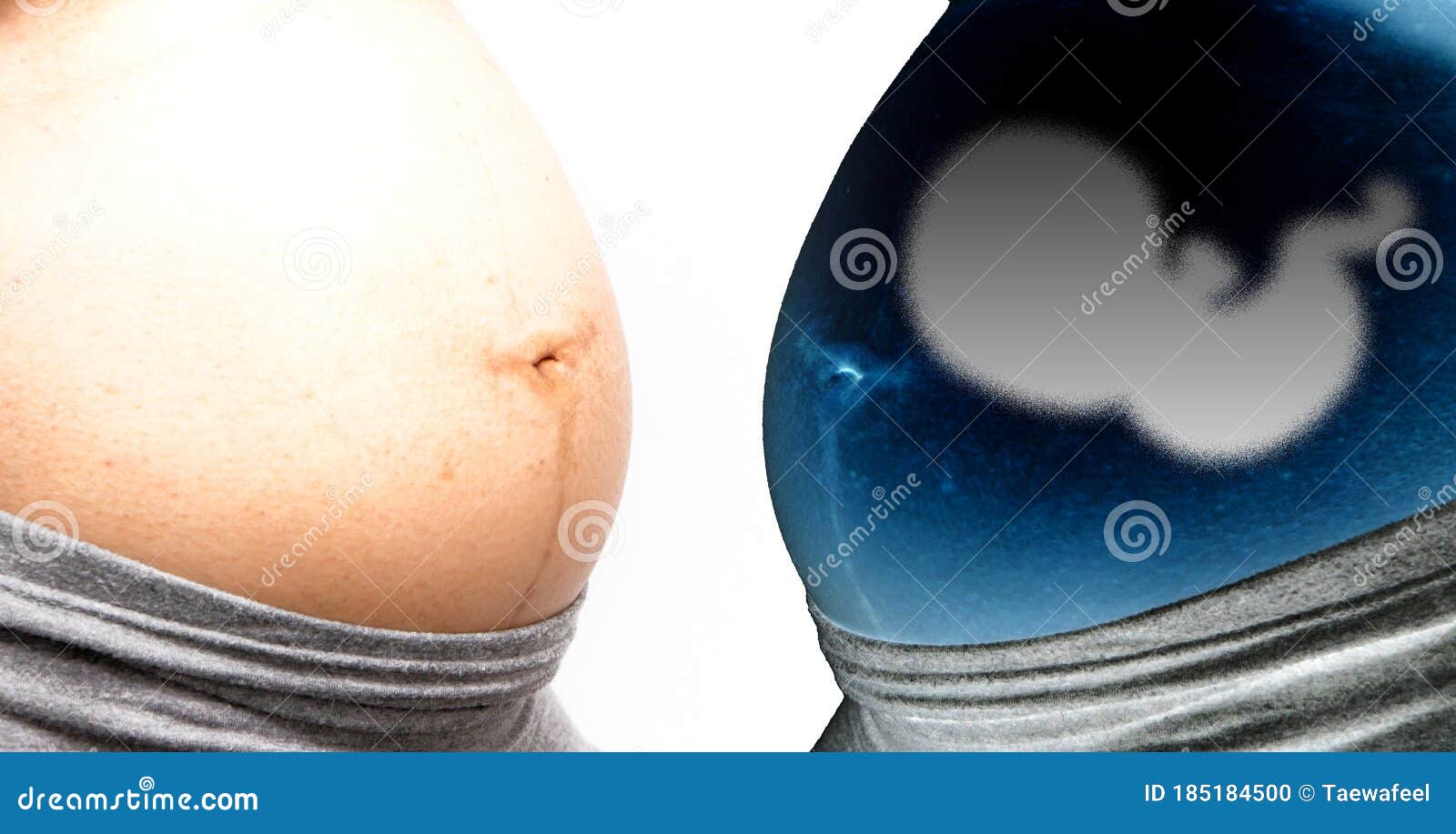 Real Stomach Image With An Image Of The Abdomen During Ultrasound Use ...