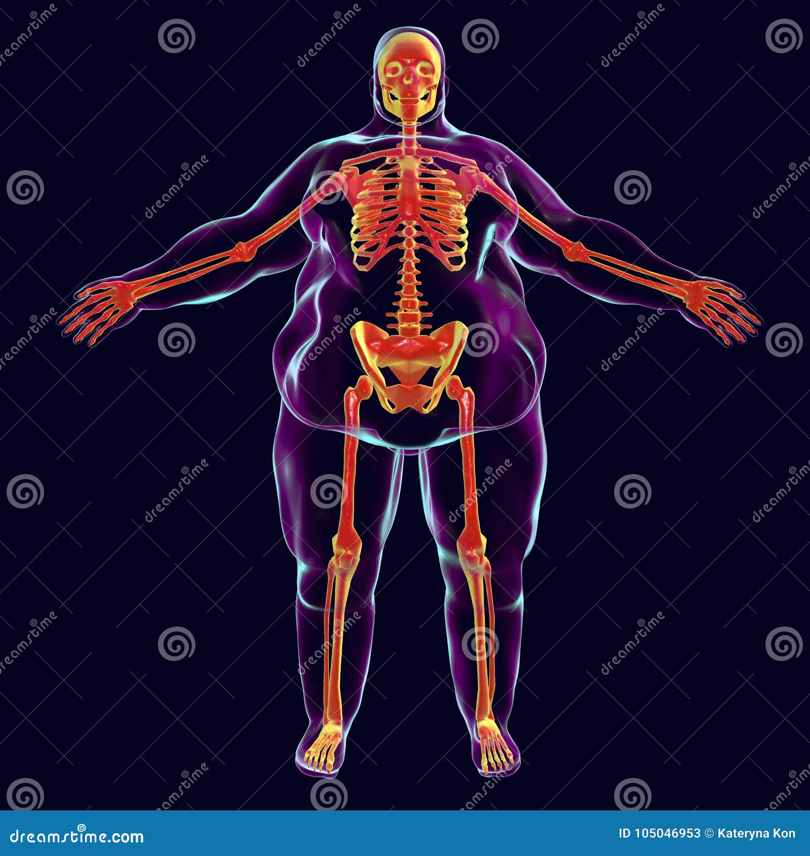 Image Conceptuelle De Problème D'obésité Illustration Stock ...