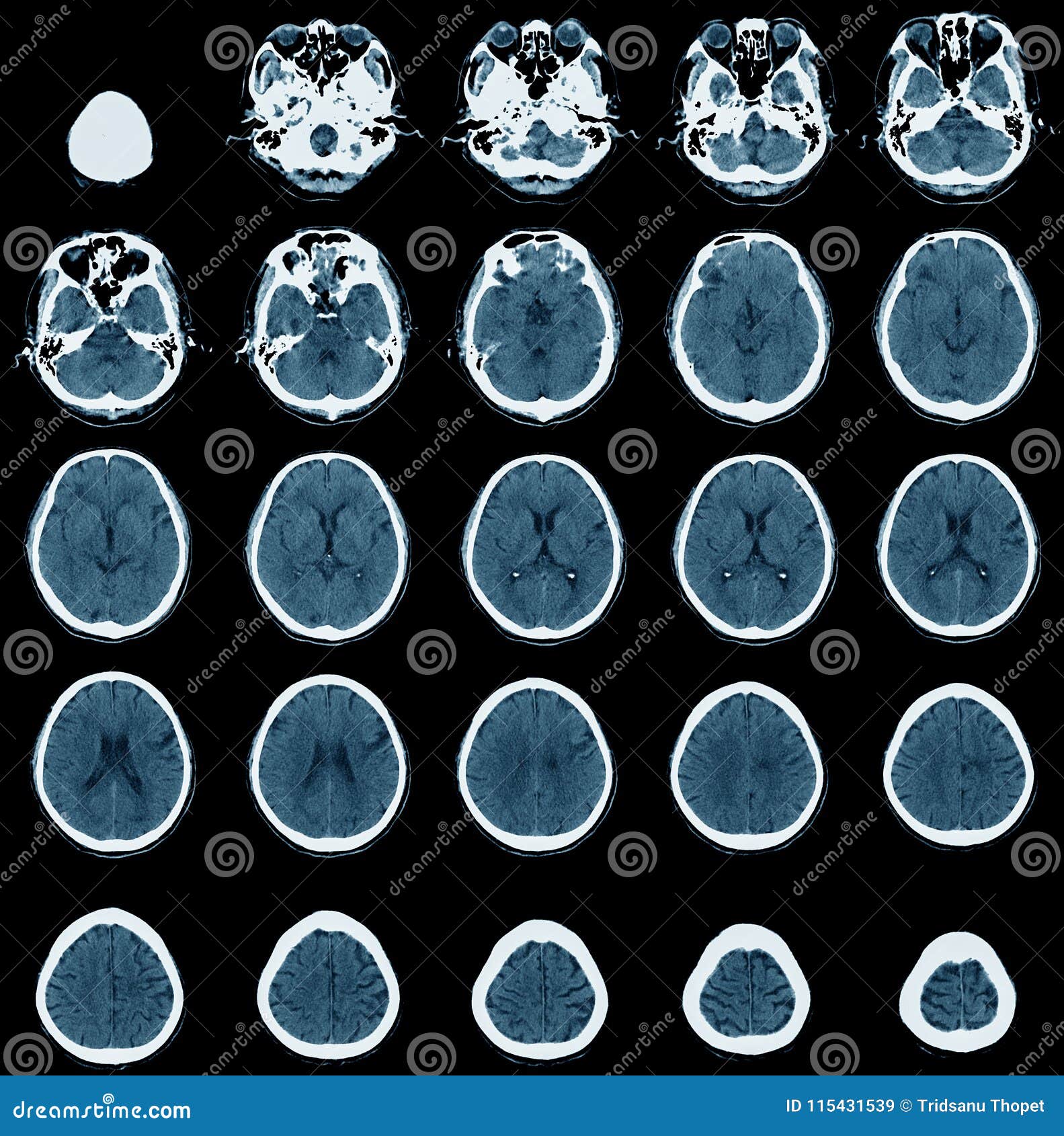 CT scan in old man stock illustration. Illustration of body - 115431539