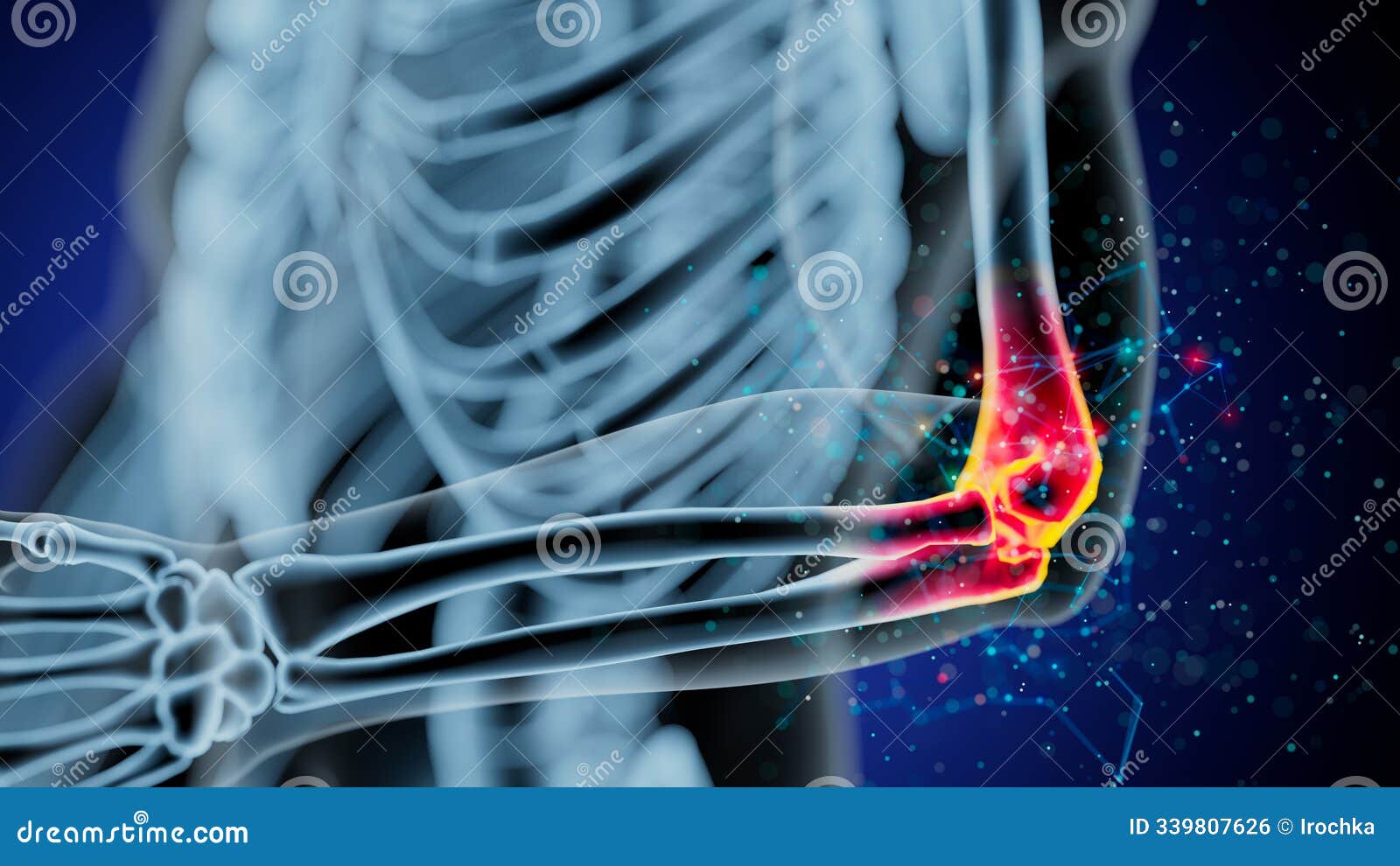 Elbow Joint Anatomy: Highlighting Inflammation with Radiant Effect ...