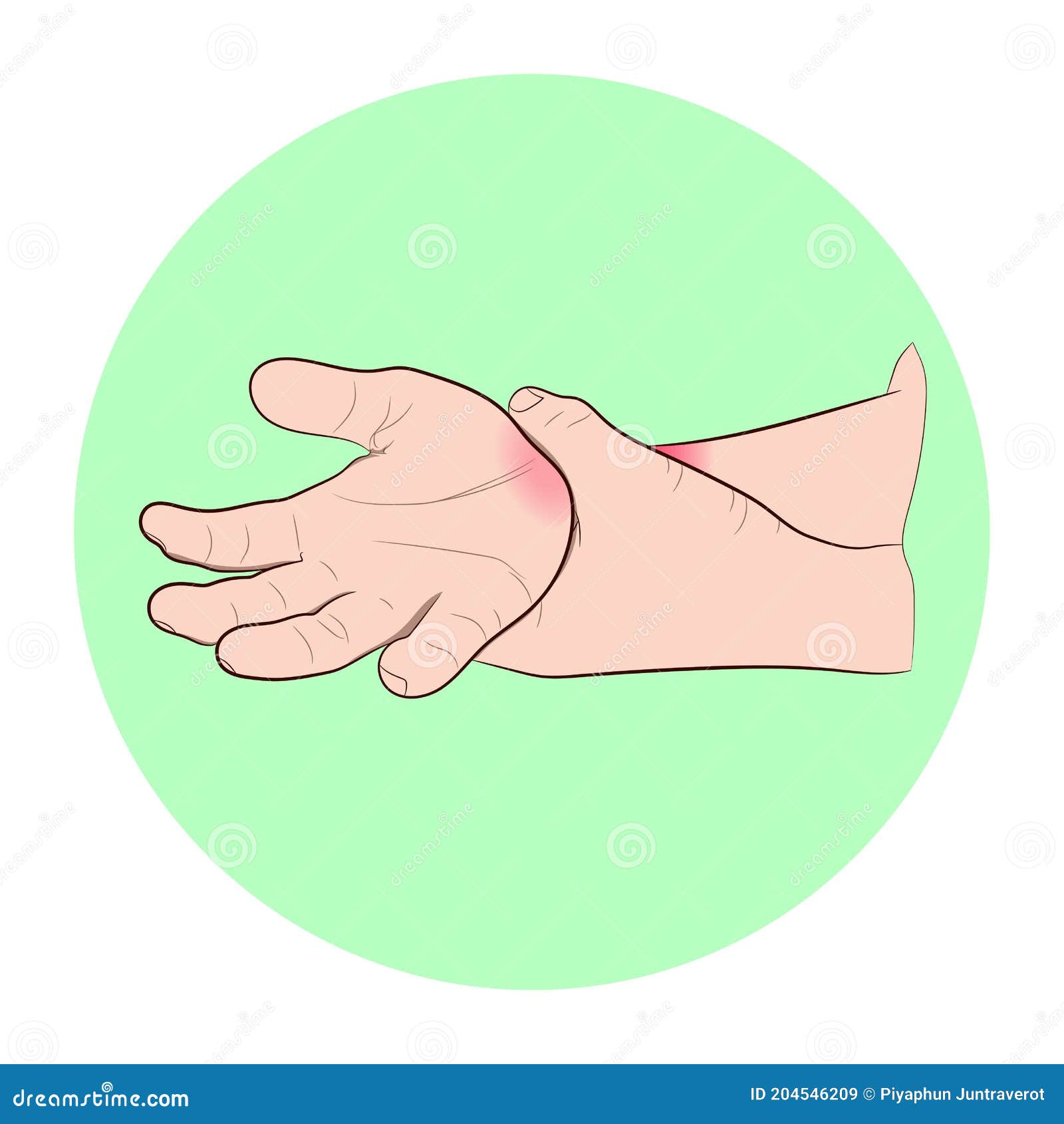 Sprains Cartoons, Illustrations & Vector Stock Images - 108 Pictures to ...