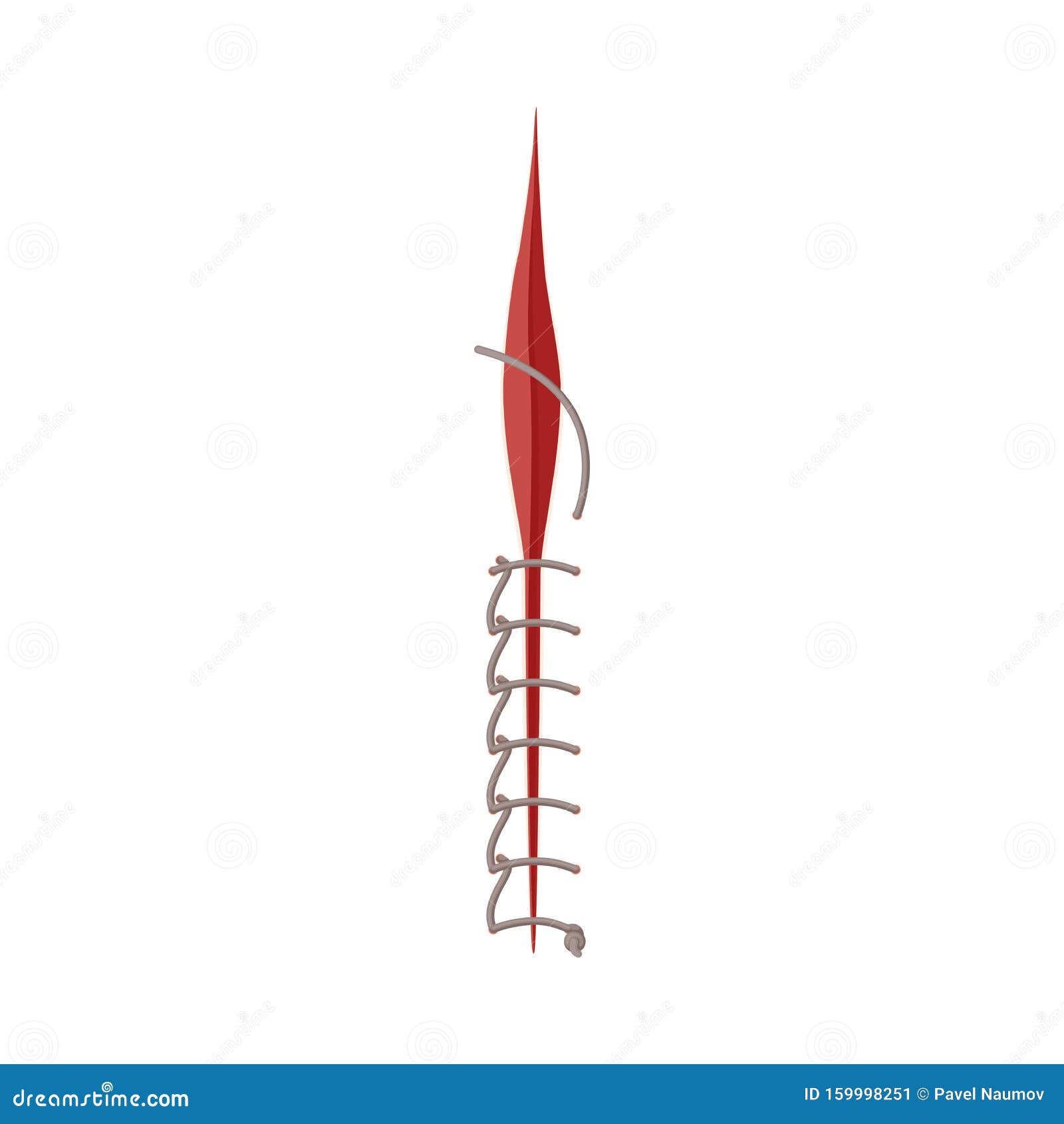 Continuous Locking Stitch