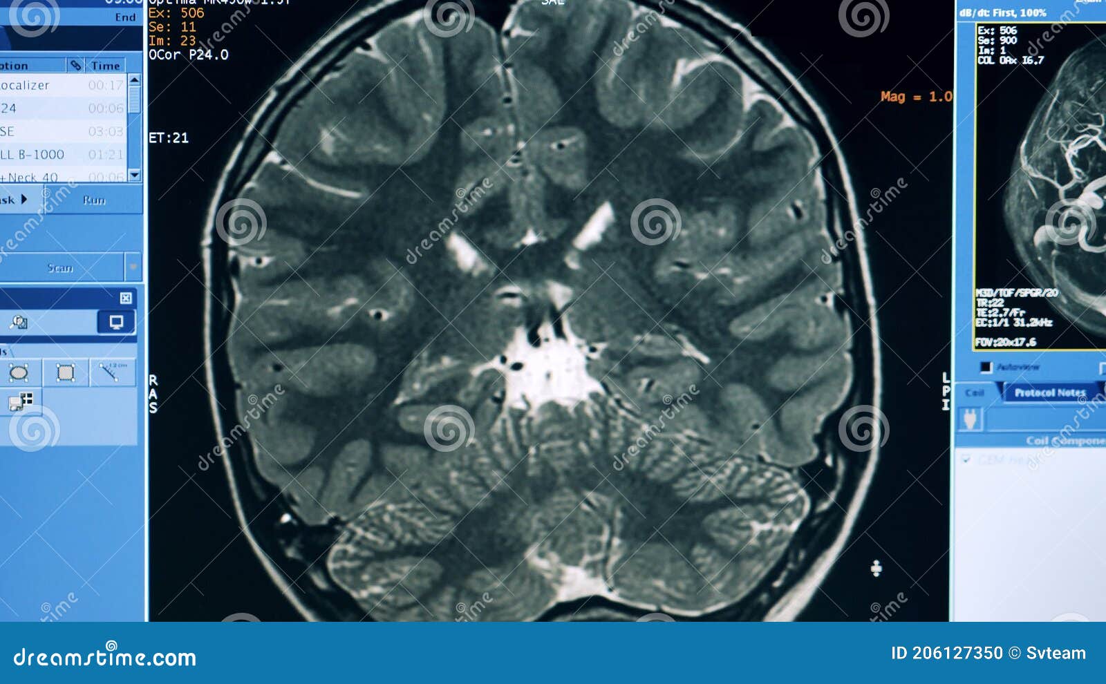 Image of a Human Brain in the MRI Interface Stock Footage - Video of ...