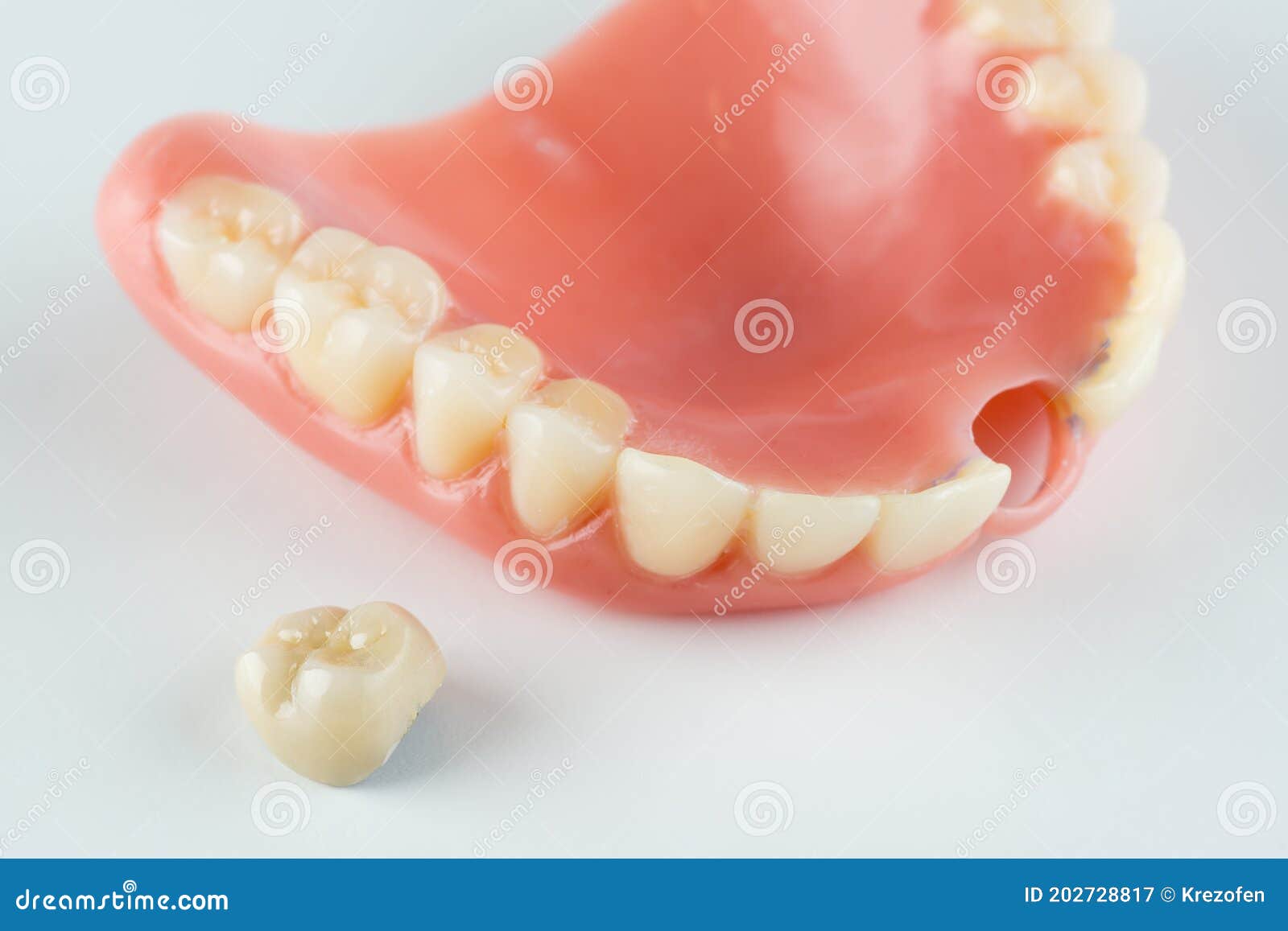Image of a Modern Denture Nylone Stock Image - Image of bugel ...