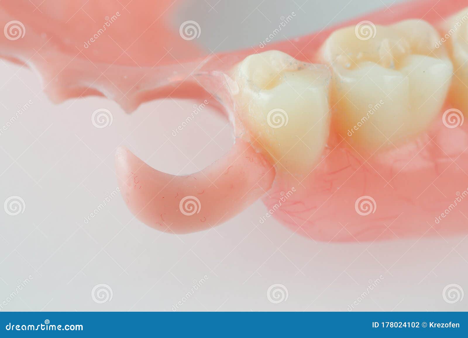 Image of a Modern Denture on a White Background Stock Photo - Image of ...
