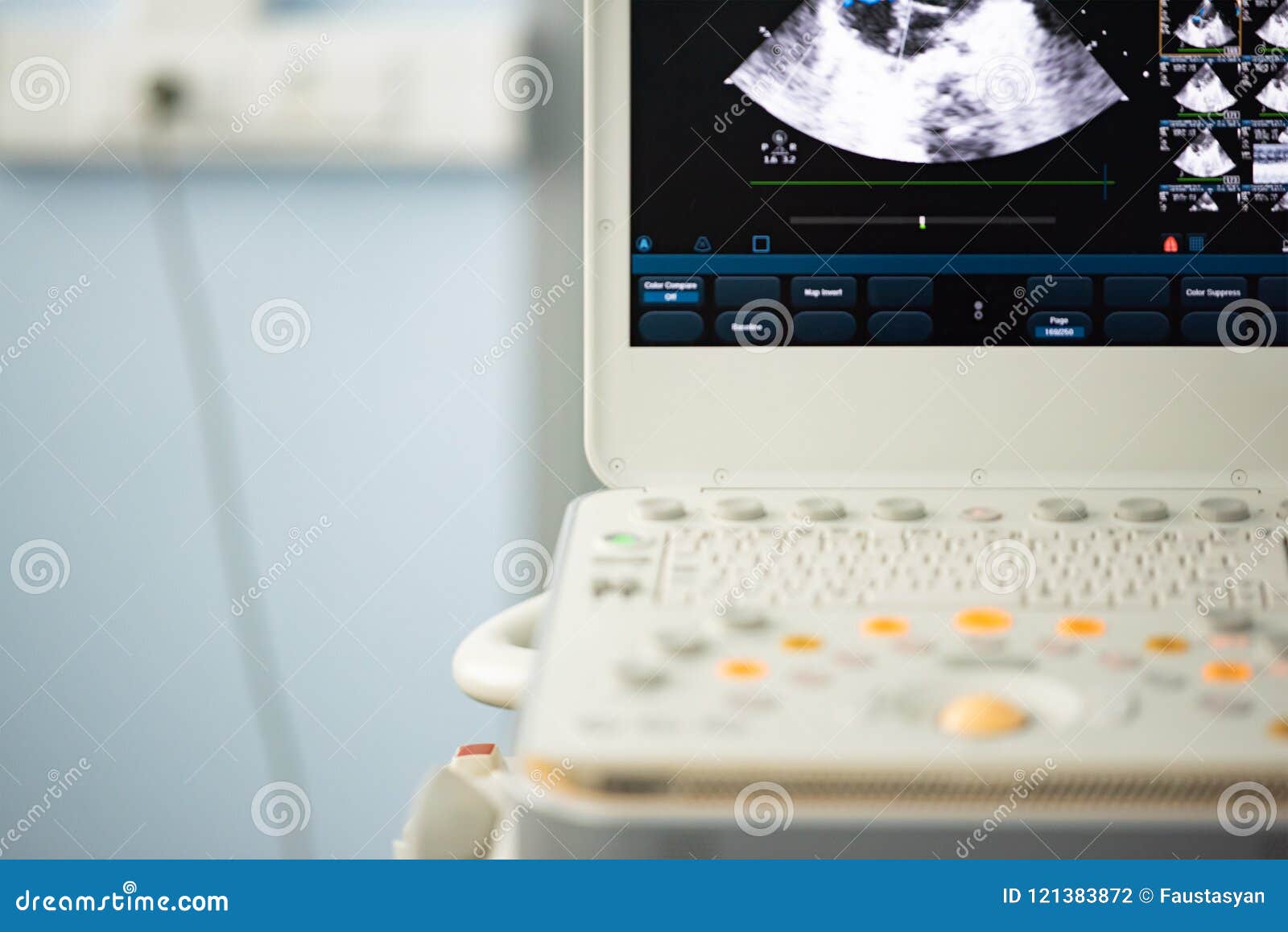 Image of a Modern Ultrasonic Scanner with a Keyboard and a Monitor ...