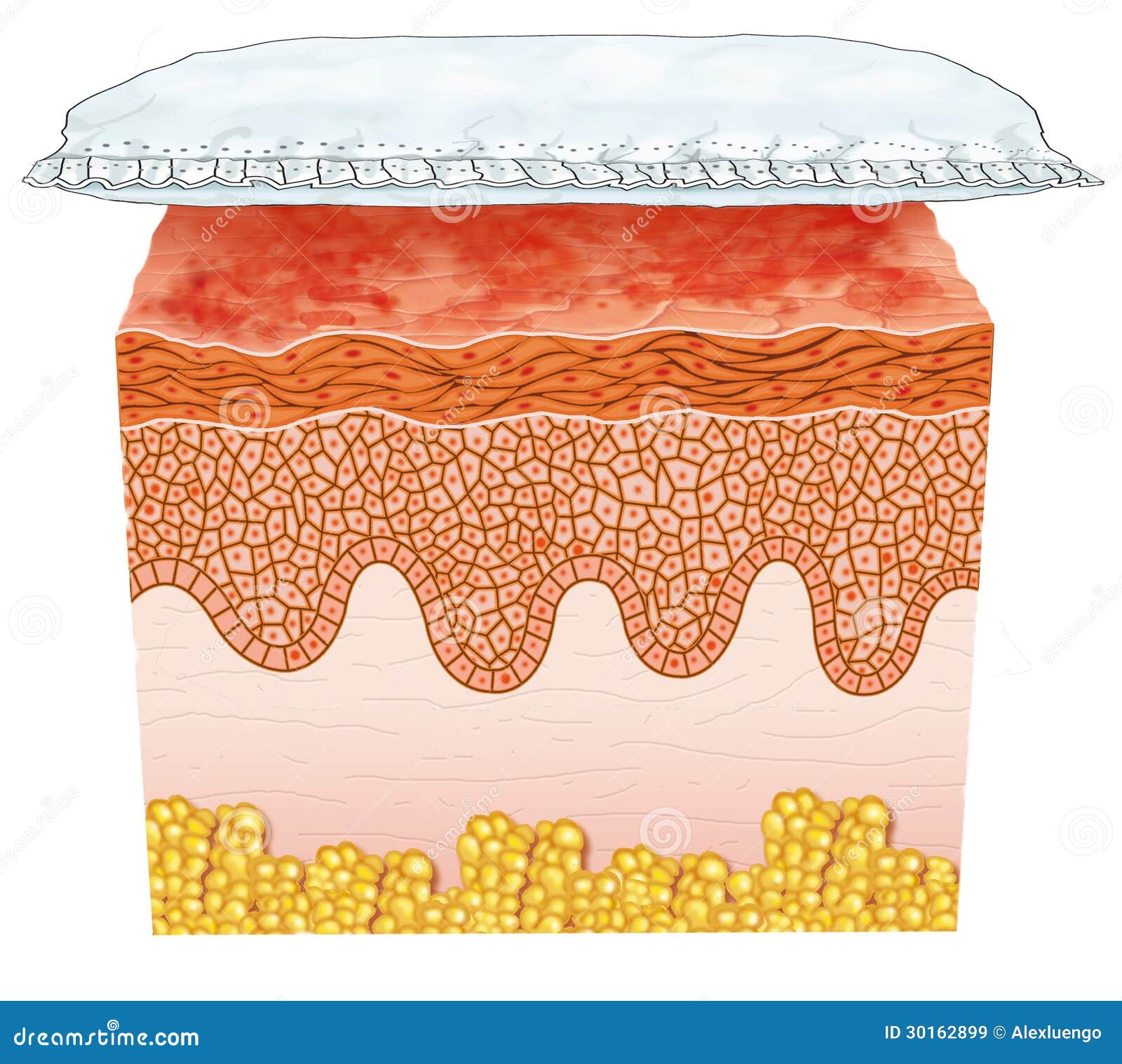 Diaper Rash stock illustration. Illustration of disease - 30162899