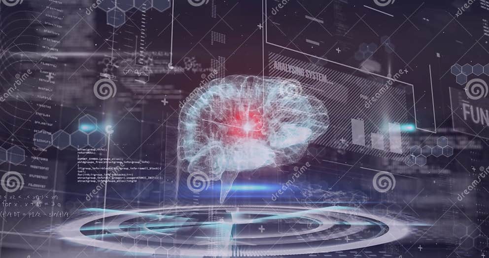Image of Scope Scanning and Data Processing Over Brain Stock Image ...