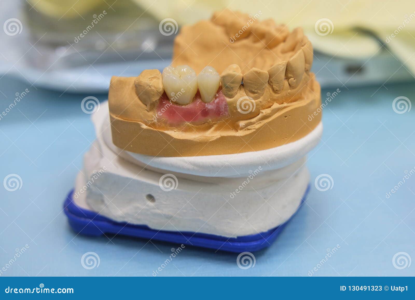 Set of the false teeth stock image. Image of denture - 130491323