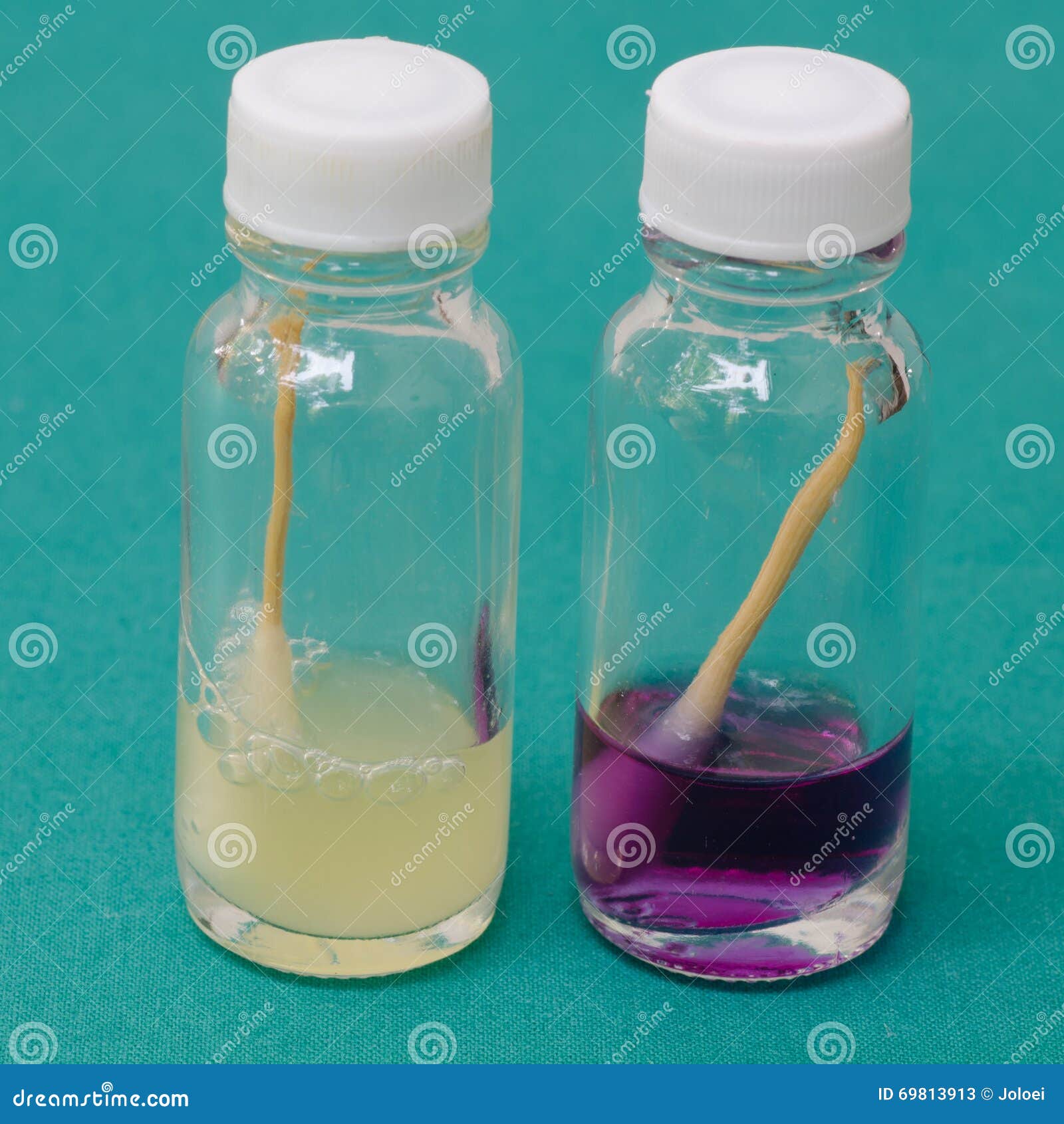 This Image Show Finding Coliform Bacteria Contamination in Food Stock ...