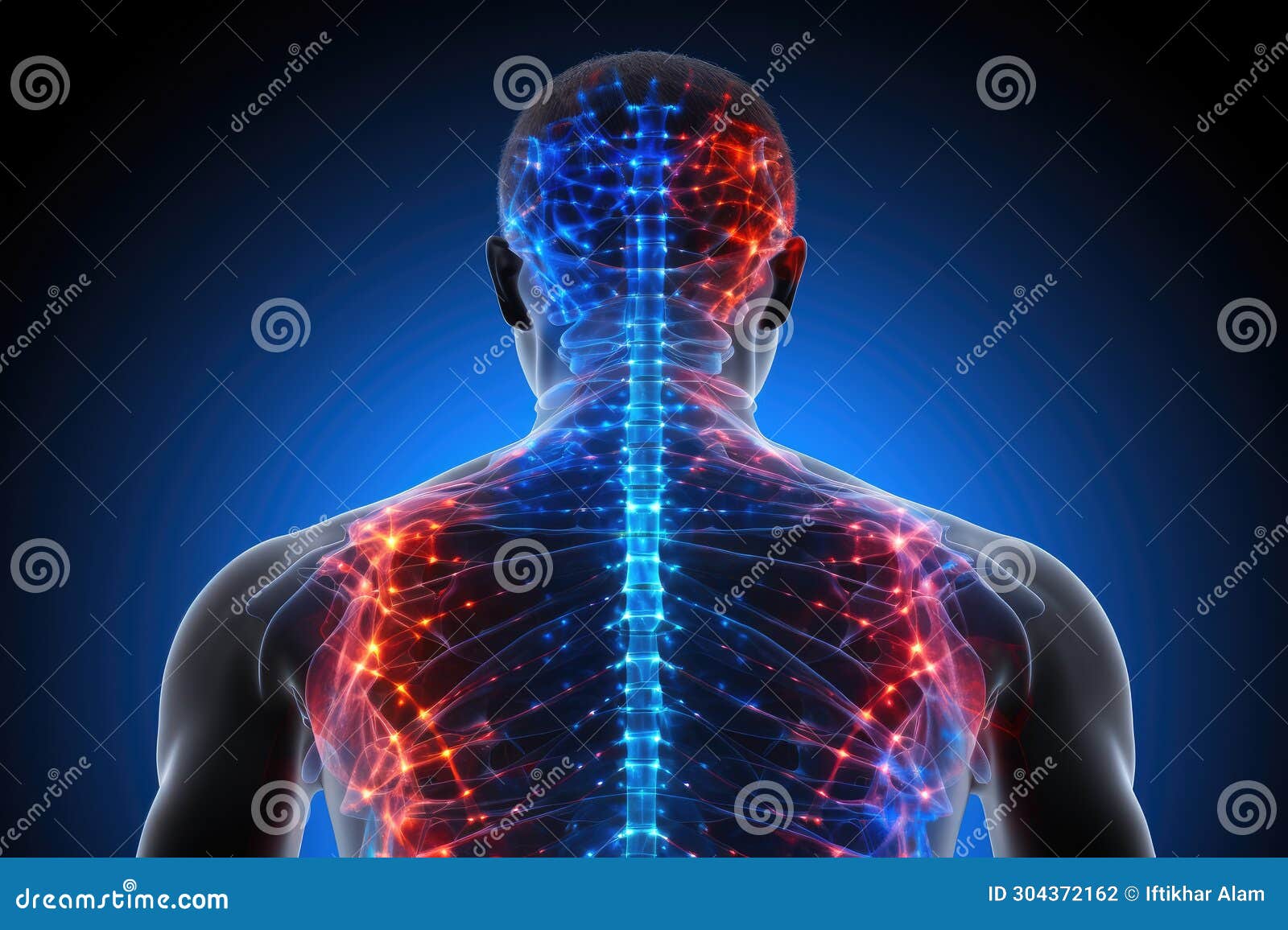 This Image Showcases the Back of a Mans Neck, Highlighting the Severity ...