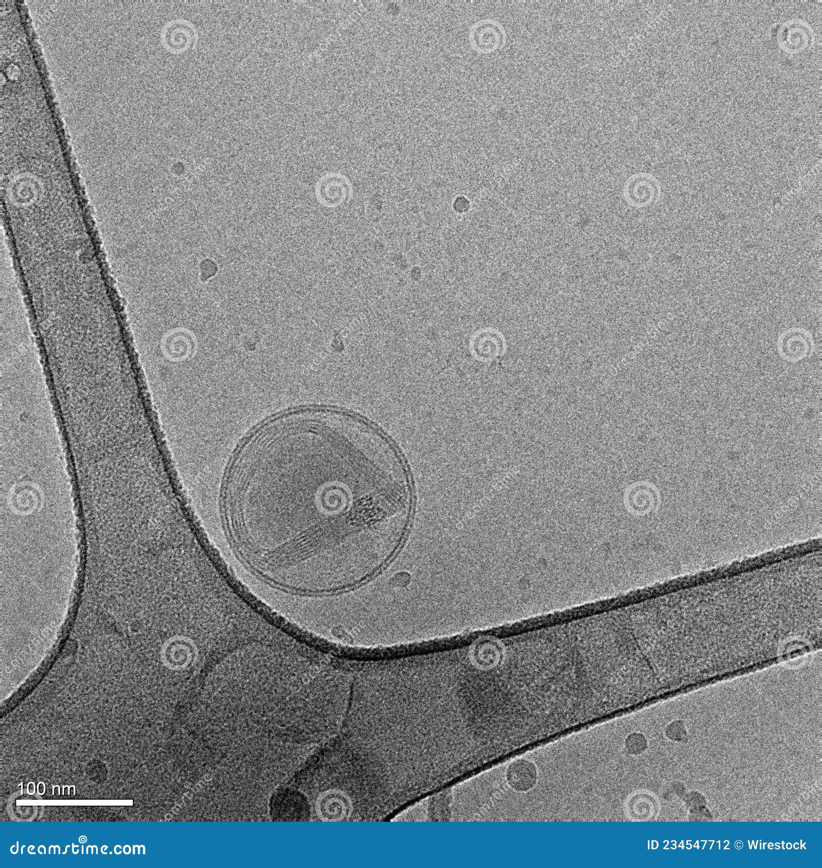Nanoparticles Made of Lipids Containing an Anticancer Drug (doxorubicin ...